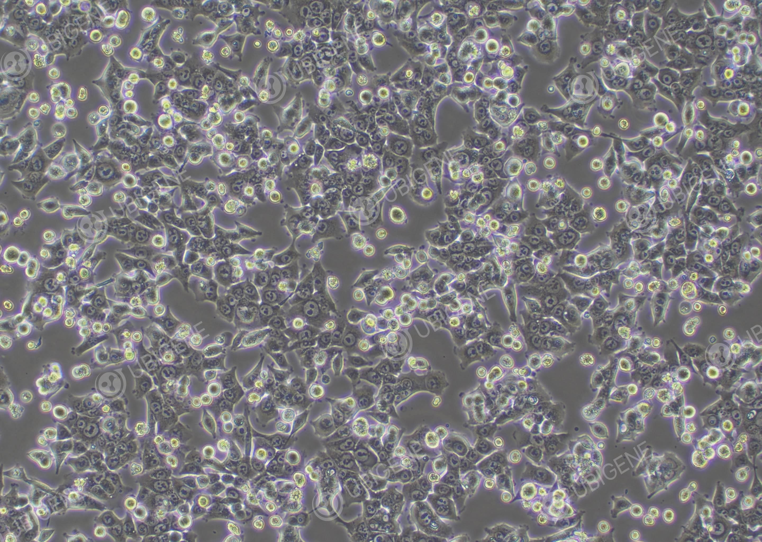 人结肠癌细胞(HCT 116-EGFP)_源井生物【官网】