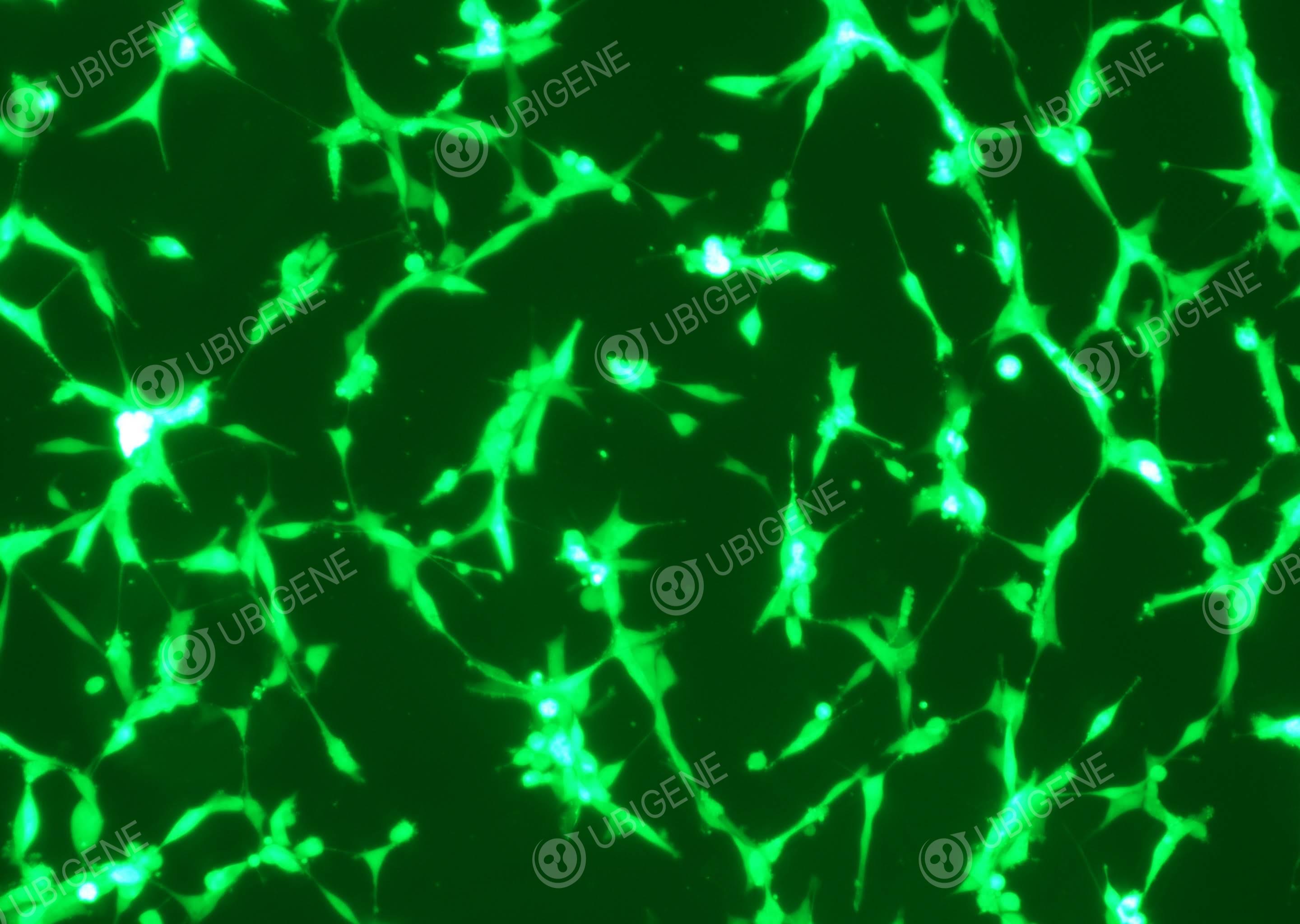 U-87 MG-EGFP cell line | Ubigene