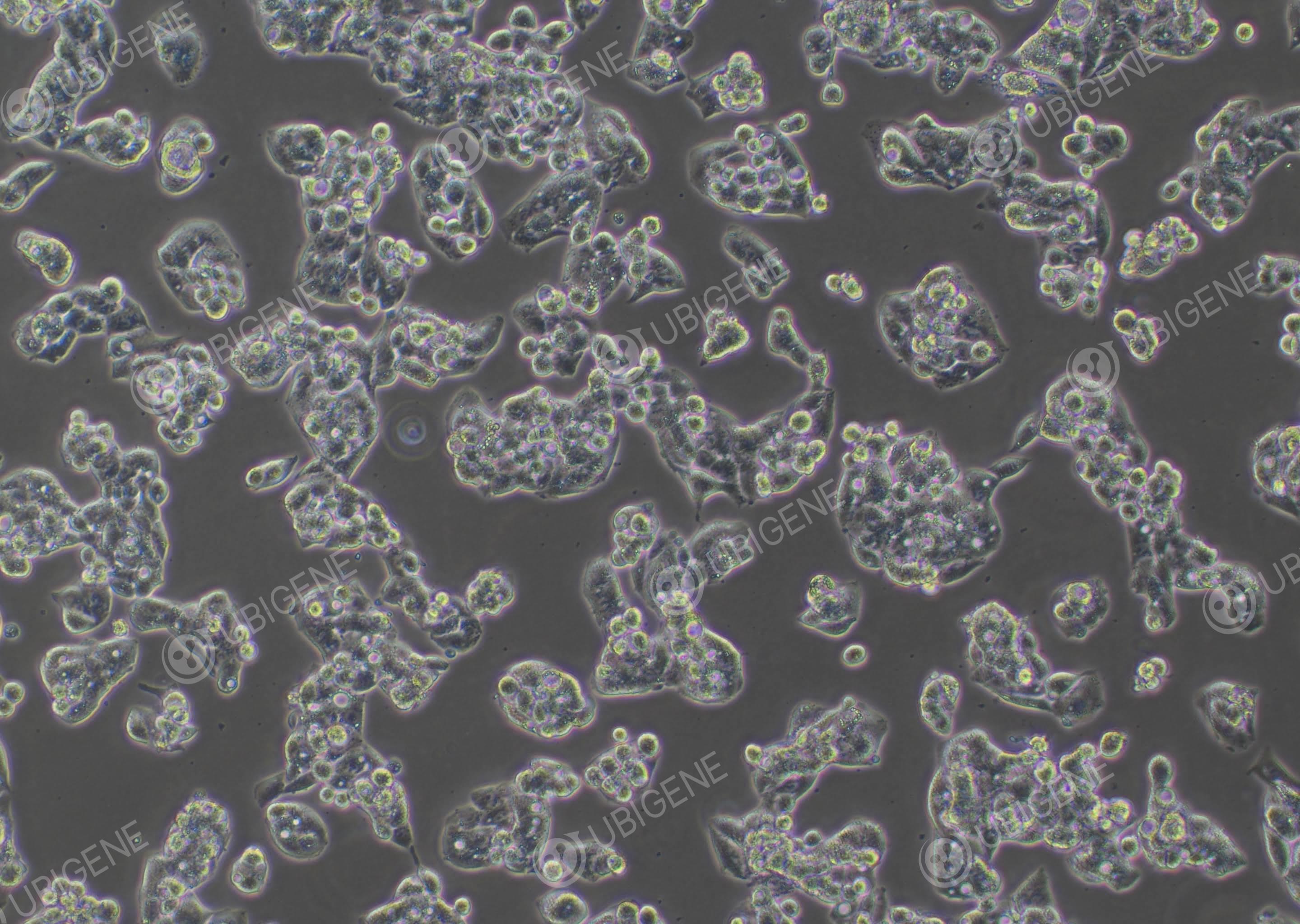 Hep G2-Luc cell line | Ubigene