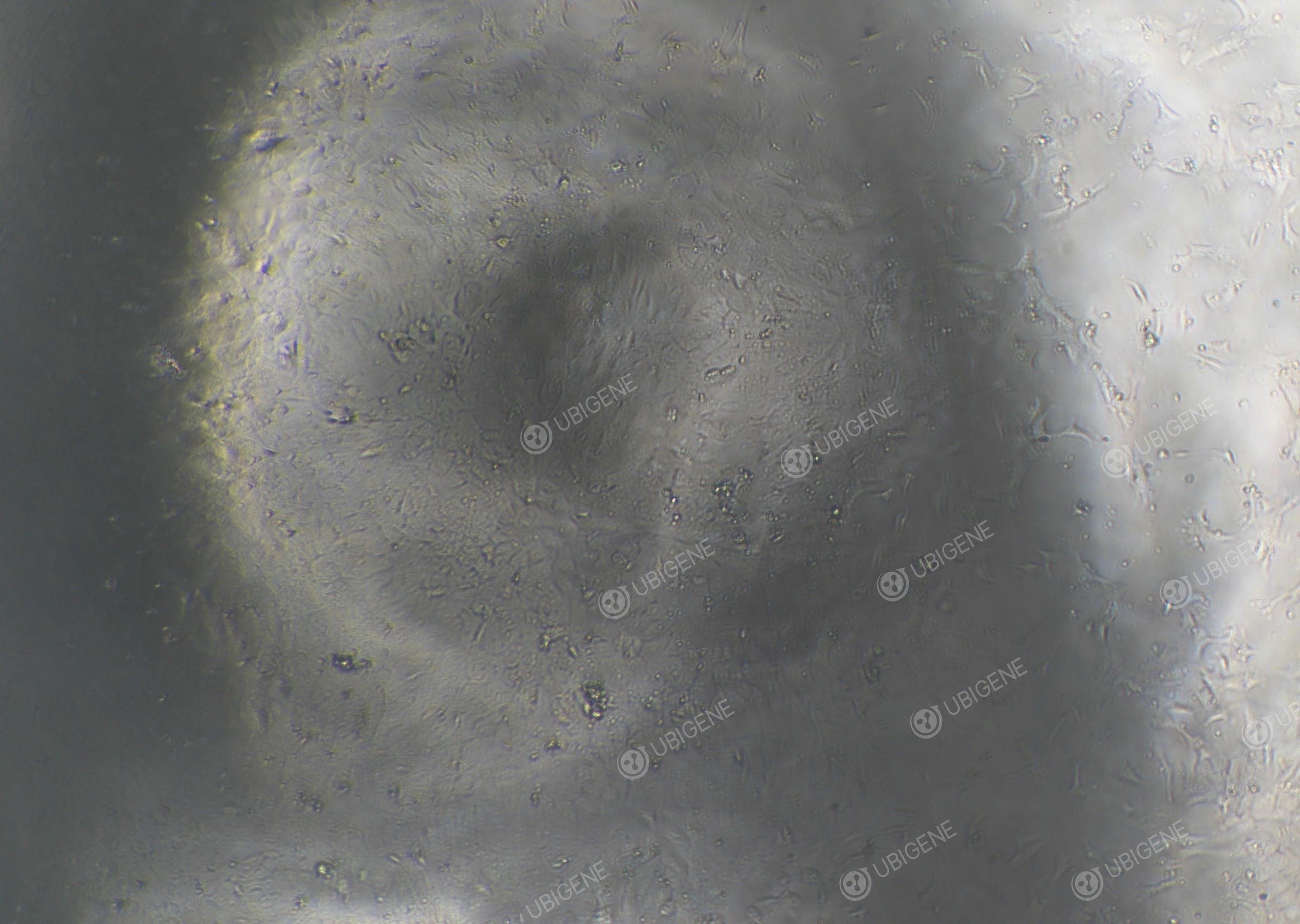 4T1 cell line | Ubigene