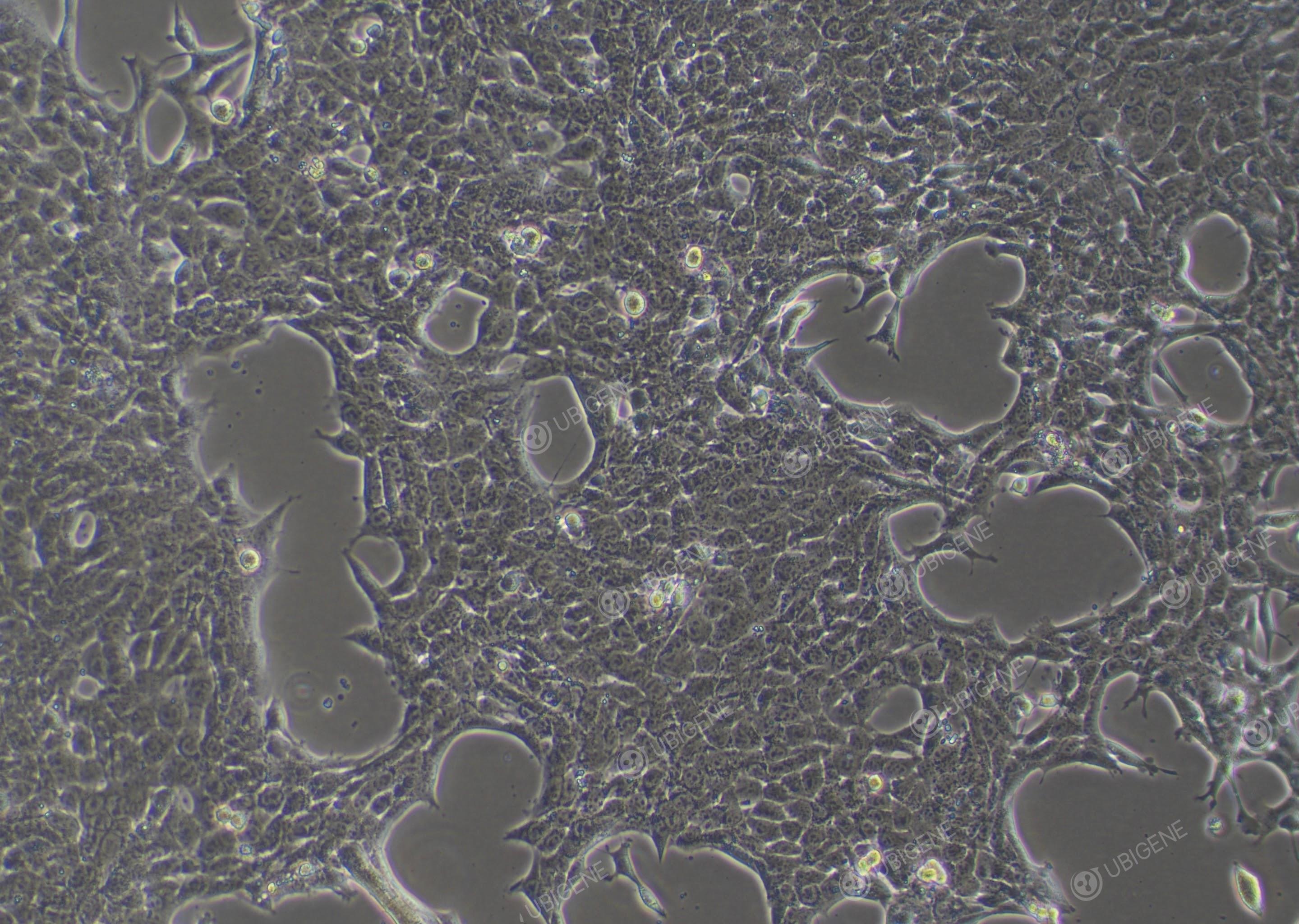 4T1 cell line | Ubigene