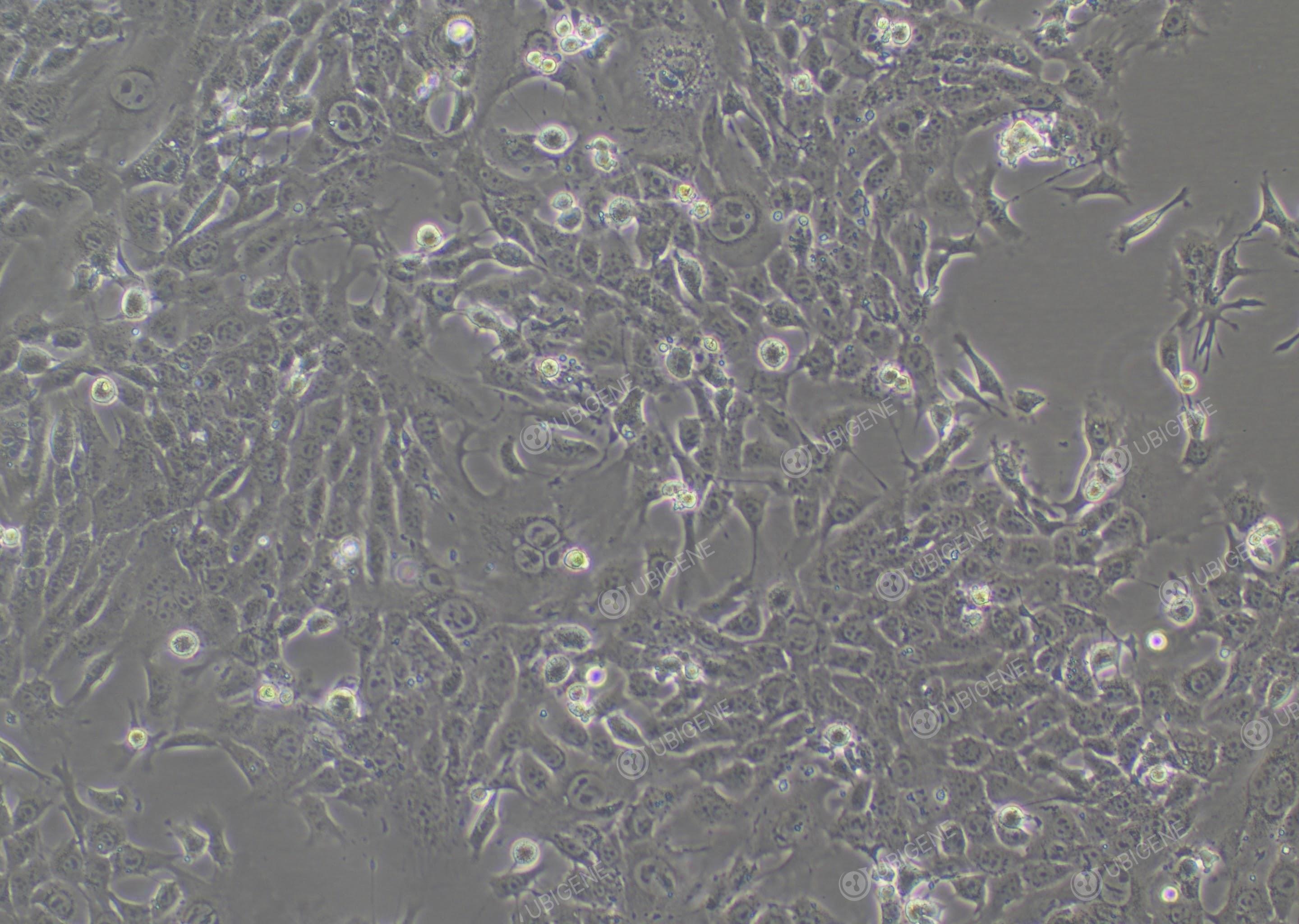 4T1 cell line | Ubigene