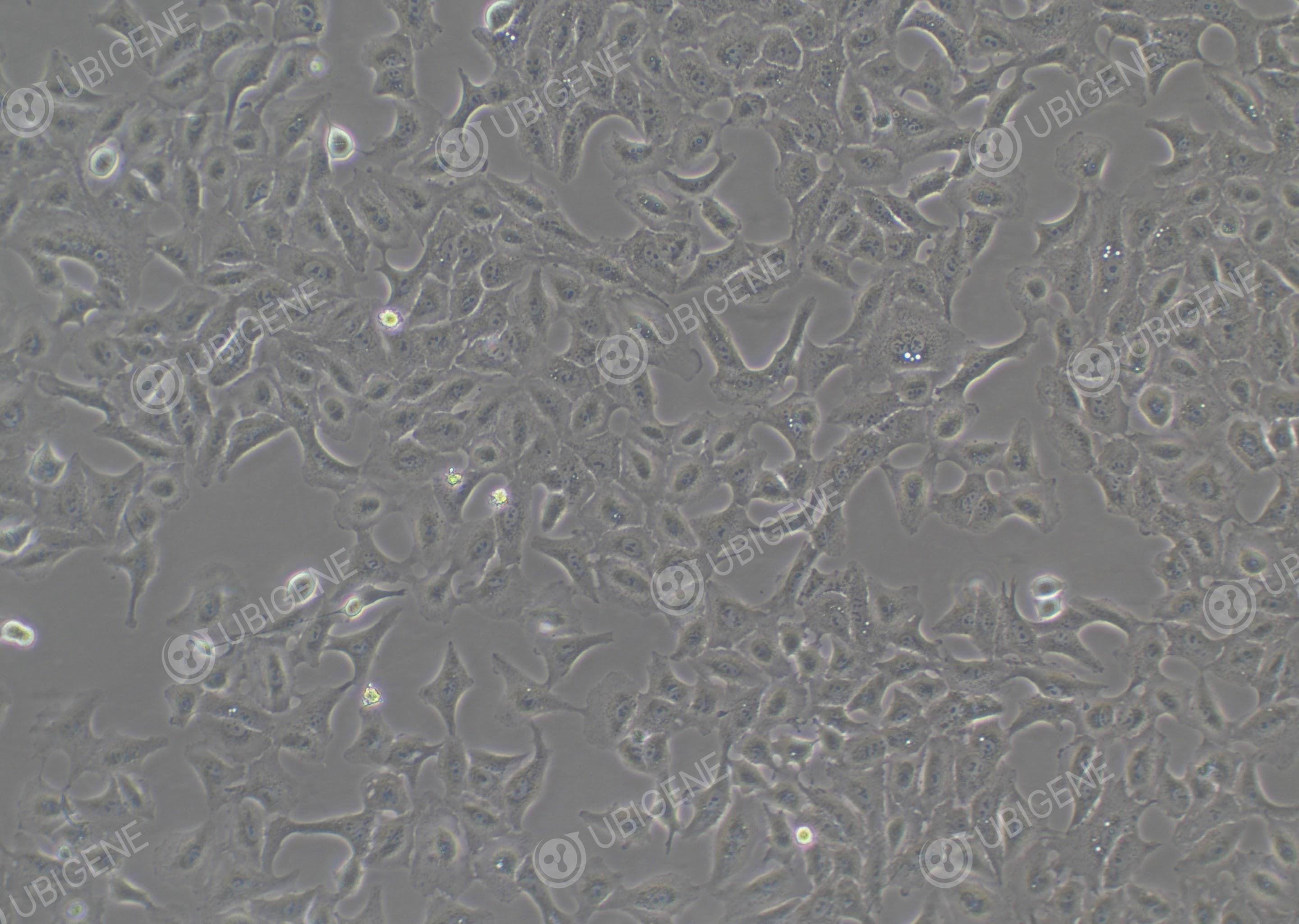 A549 cell line | Ubigene