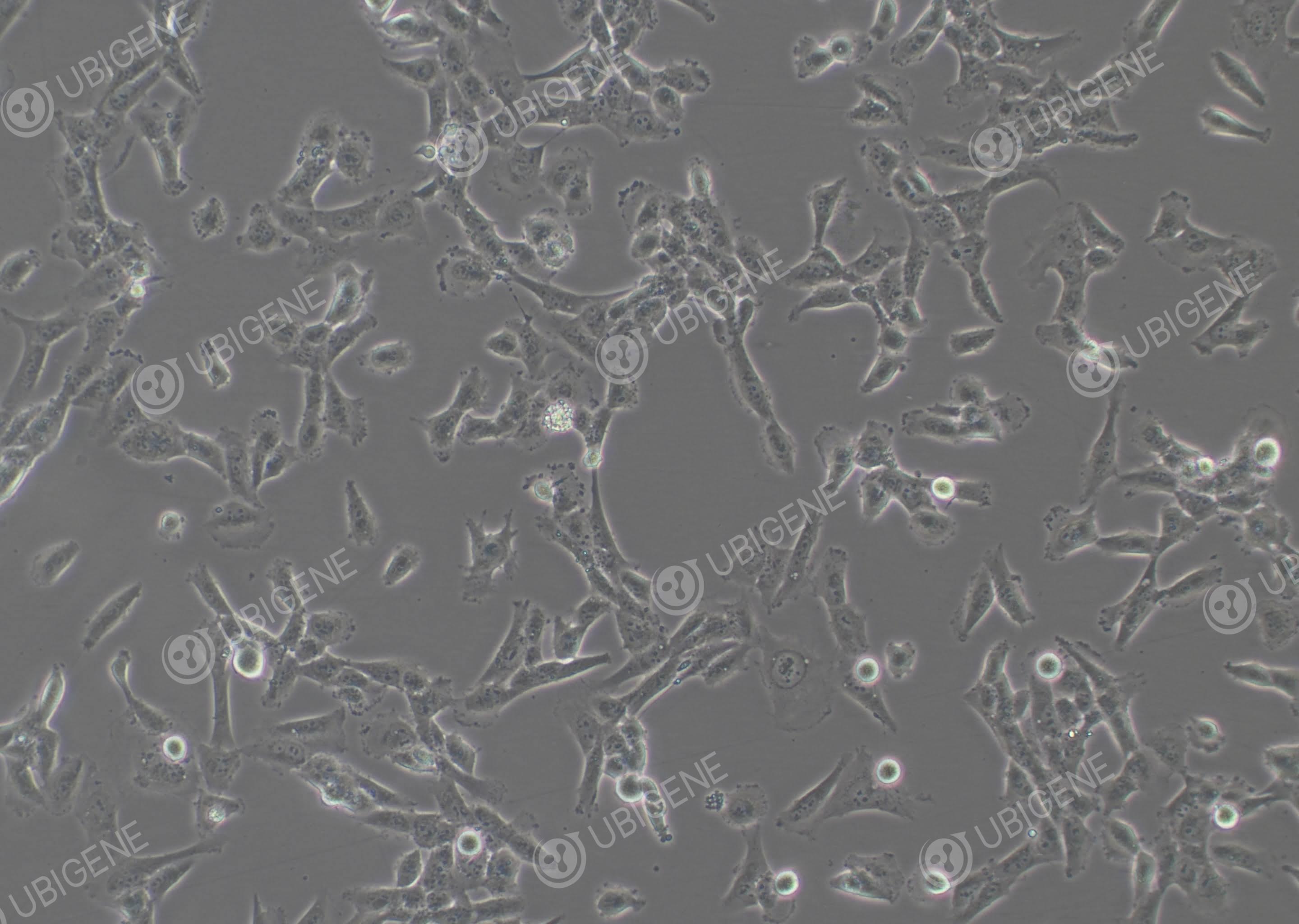 AC16 cell line | Ubigene