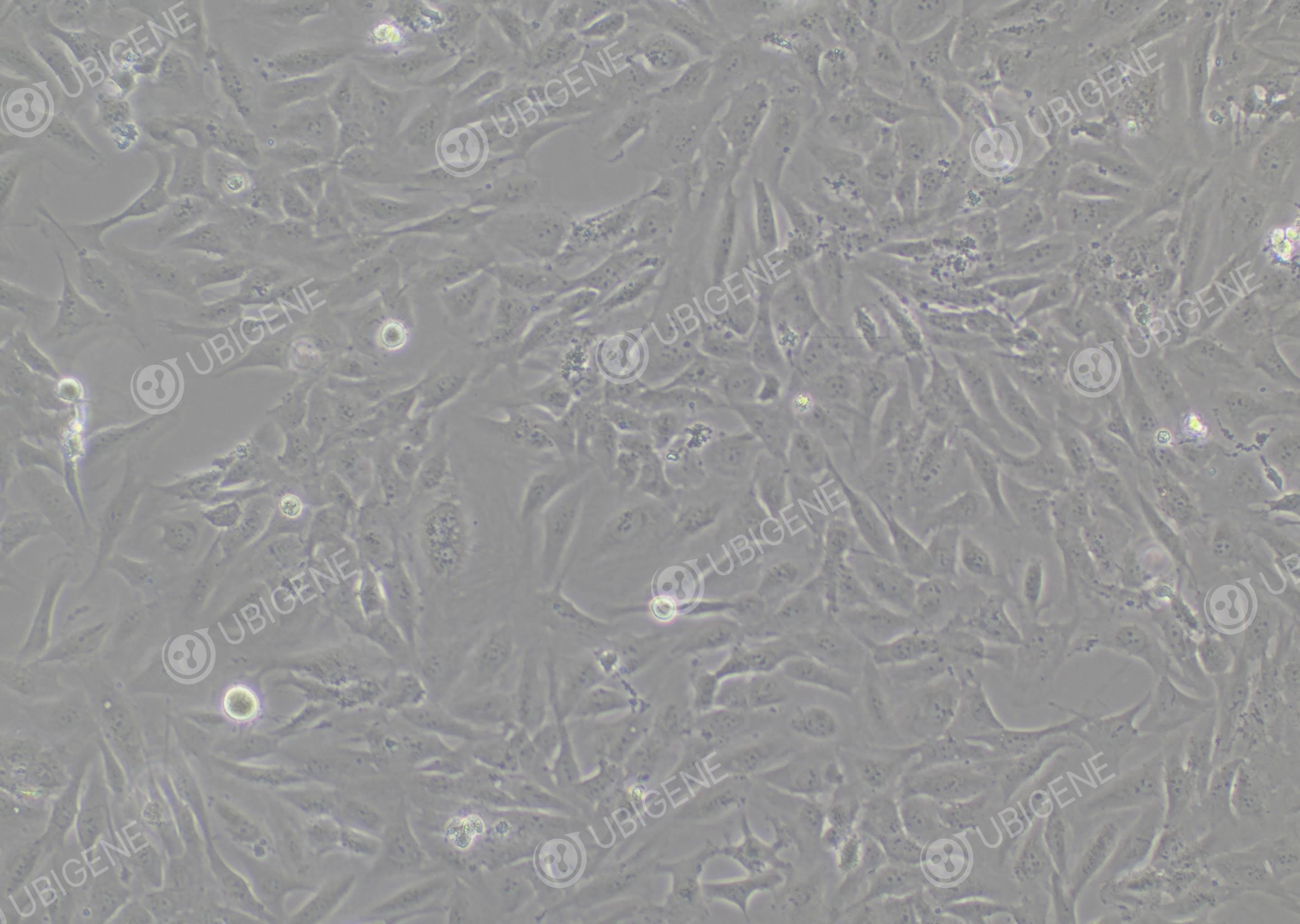 AC16 cell line | Ubigene