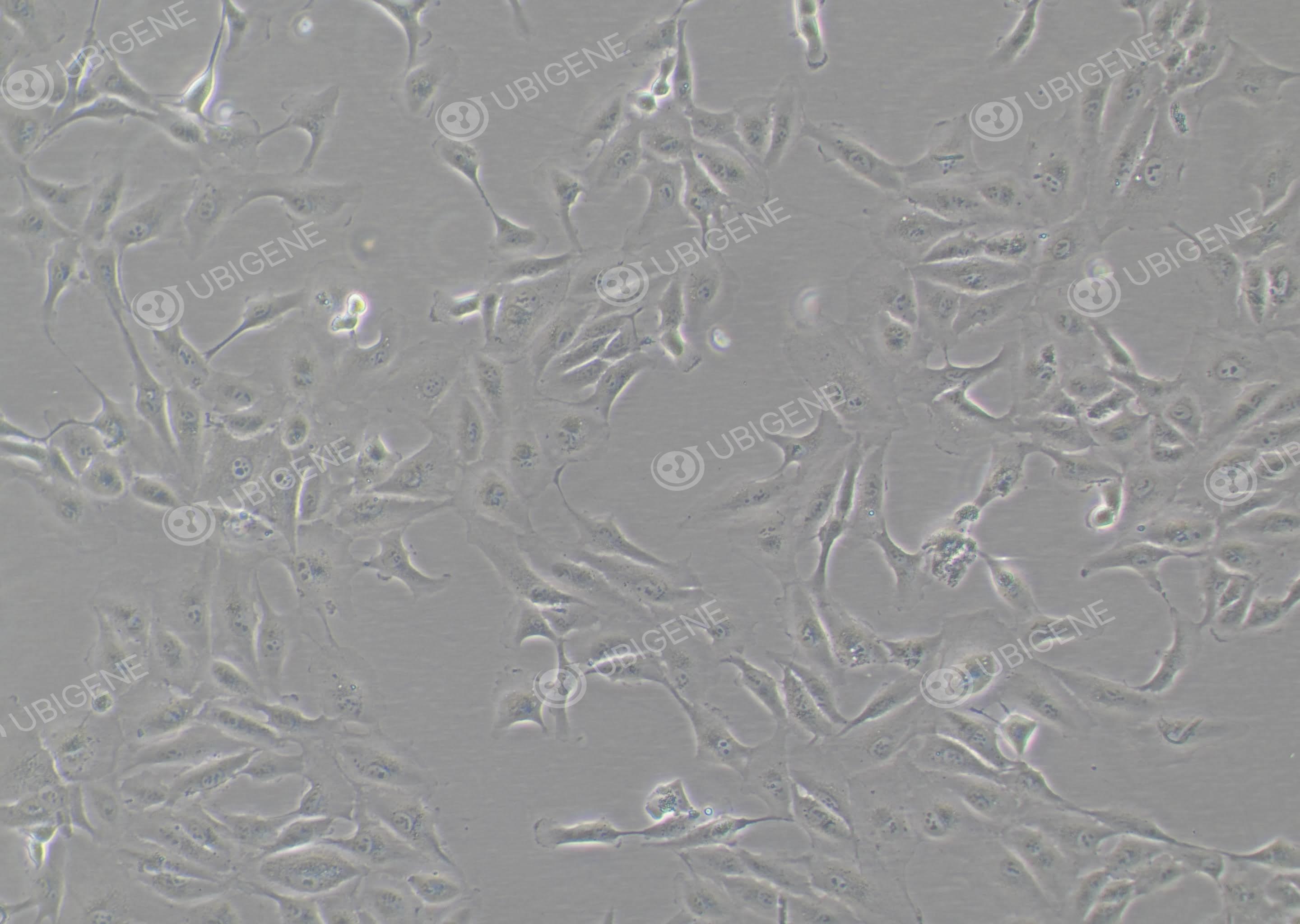 ARPE-19 cell line | Ubigene