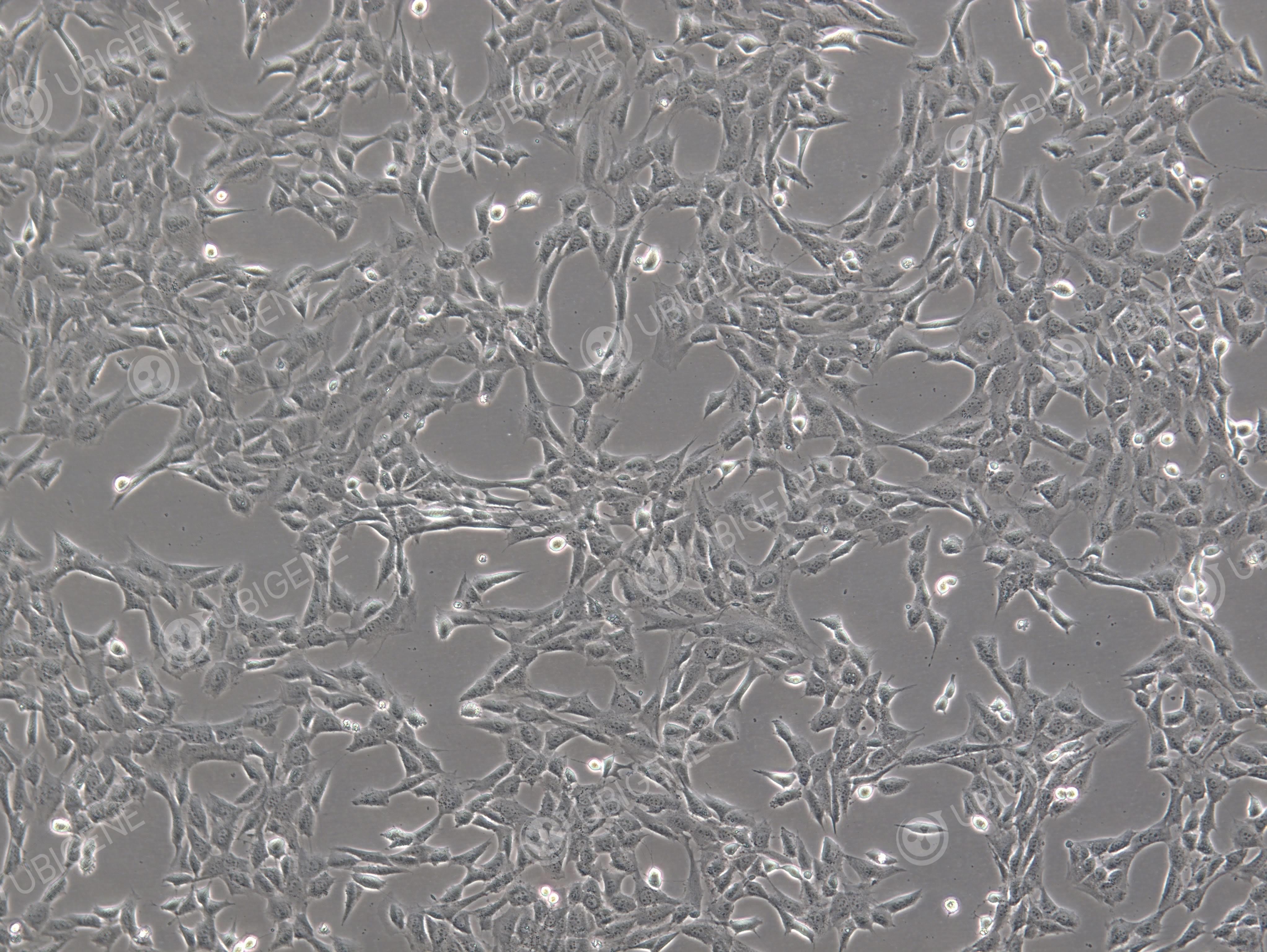 ATDC5 cell line | Ubigene