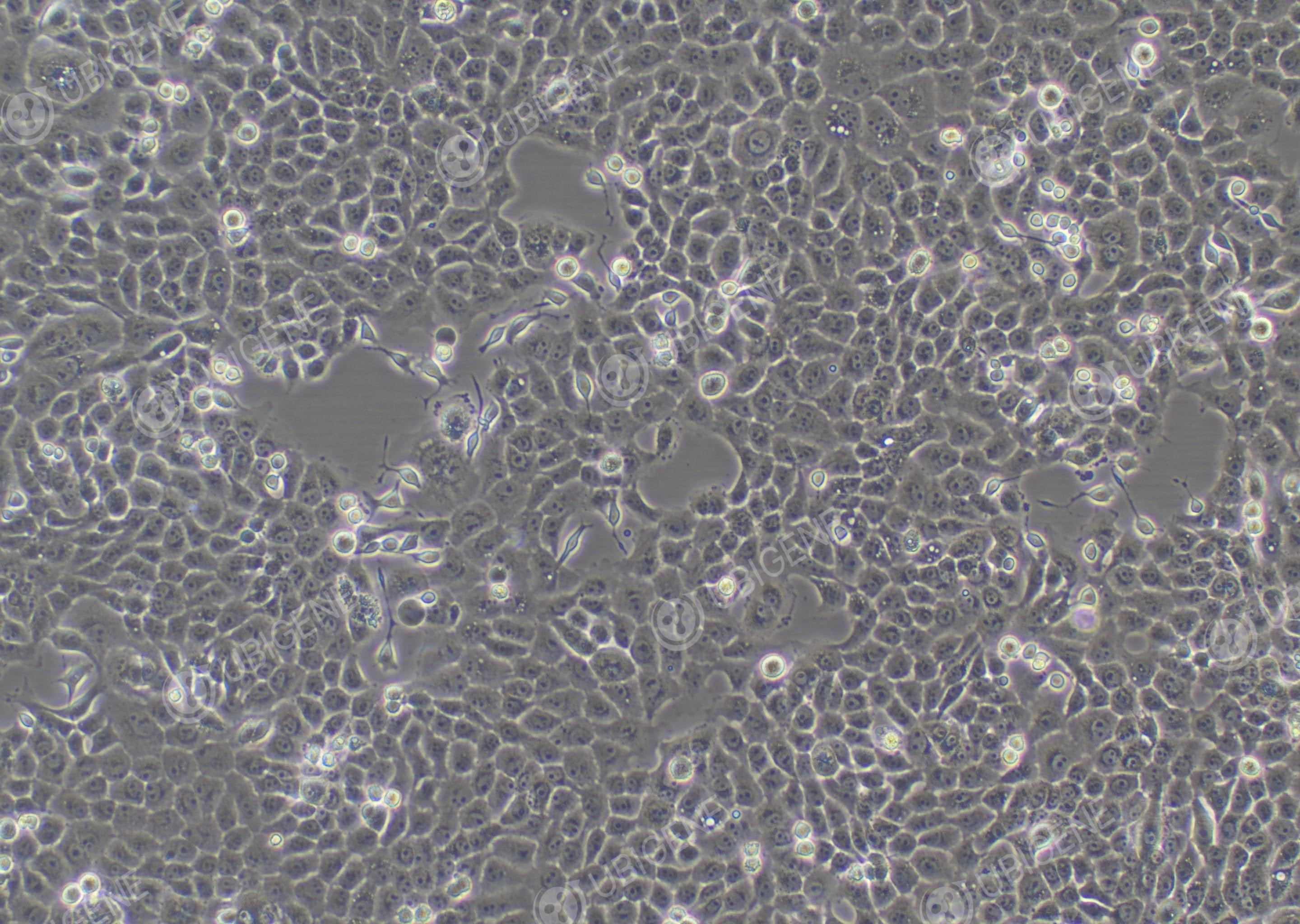 CAL-27 cell line | Ubigene