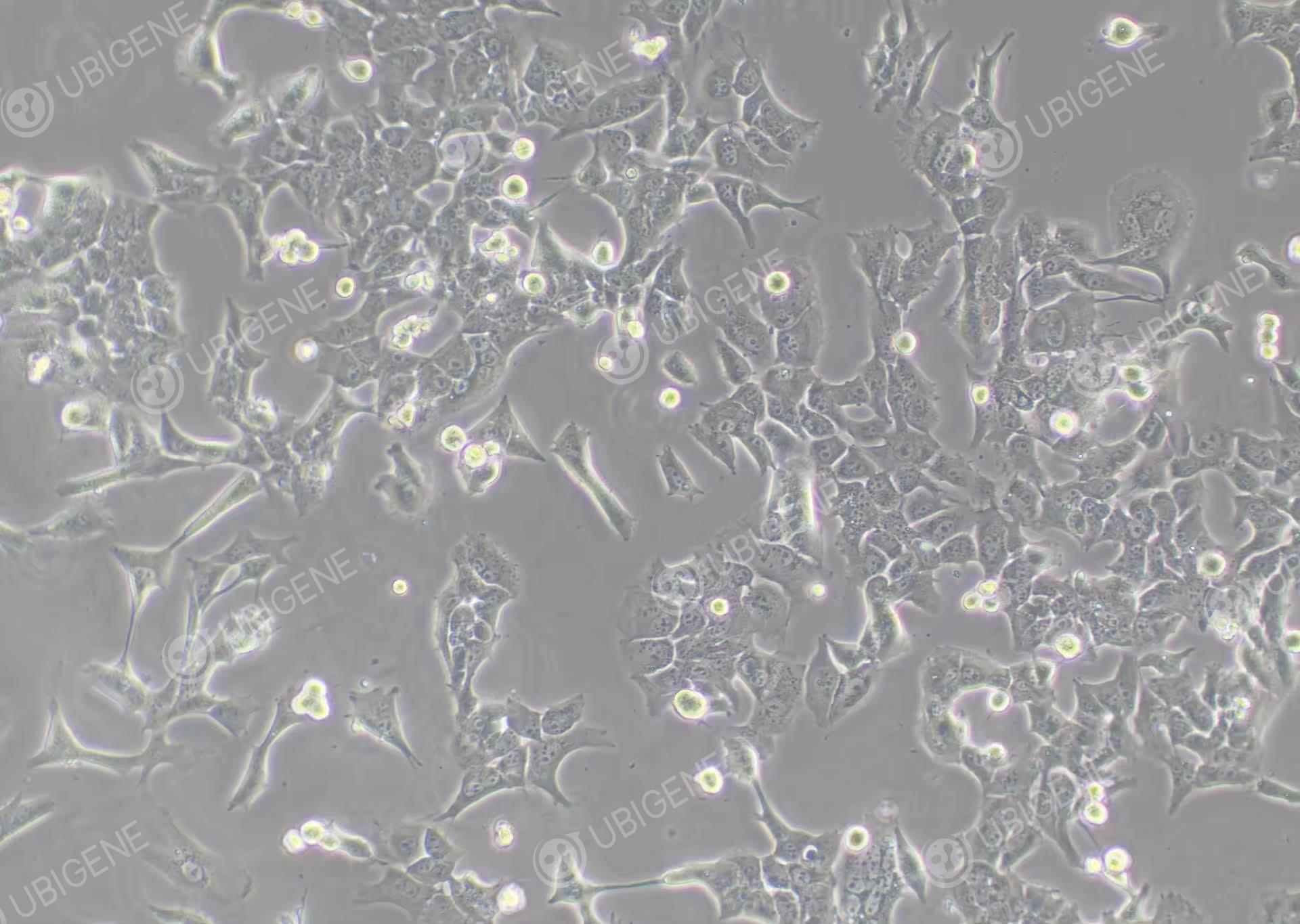 GL261-Luc cell line | Ubigene