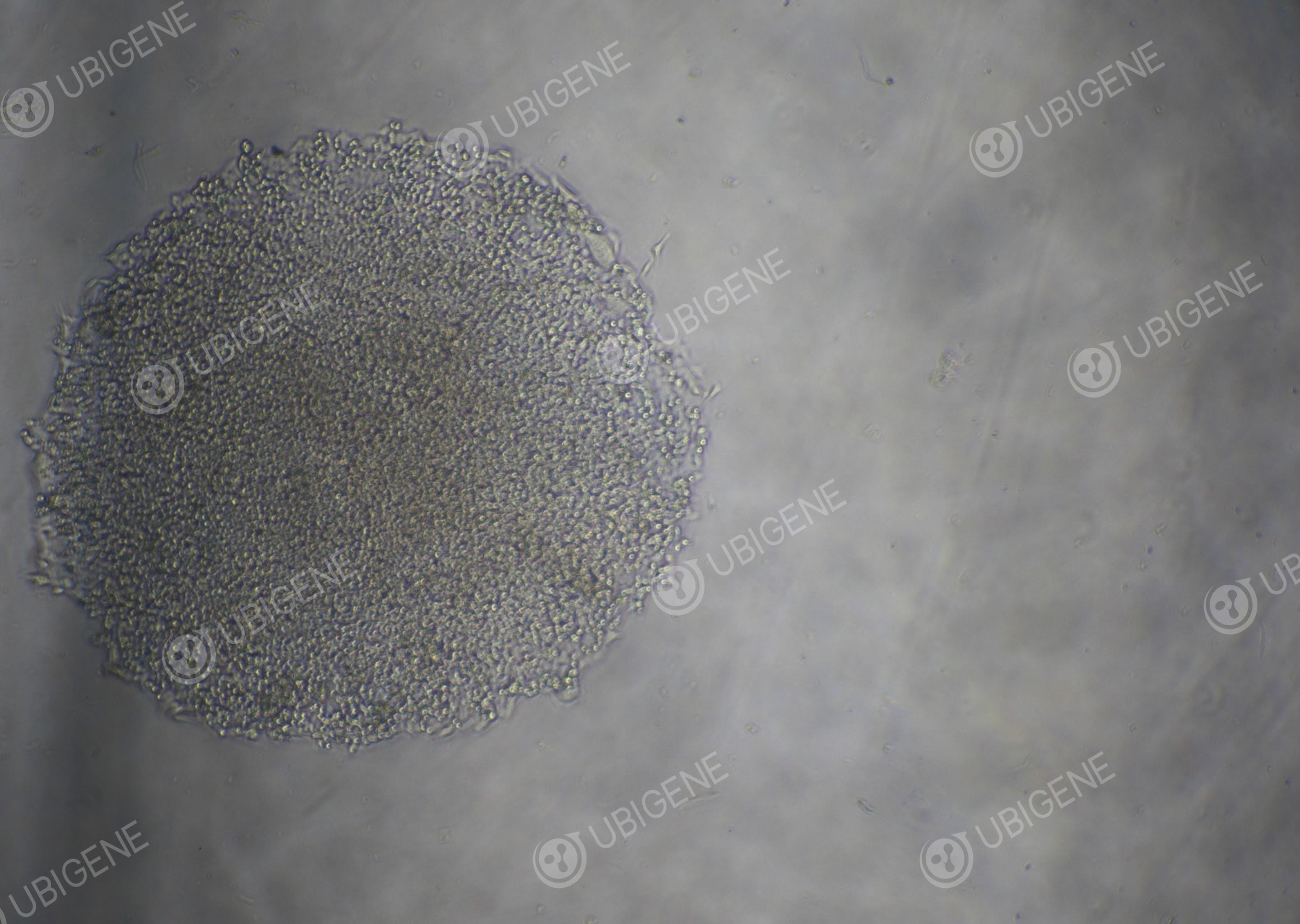 HCT 116 cell line | Ubigene