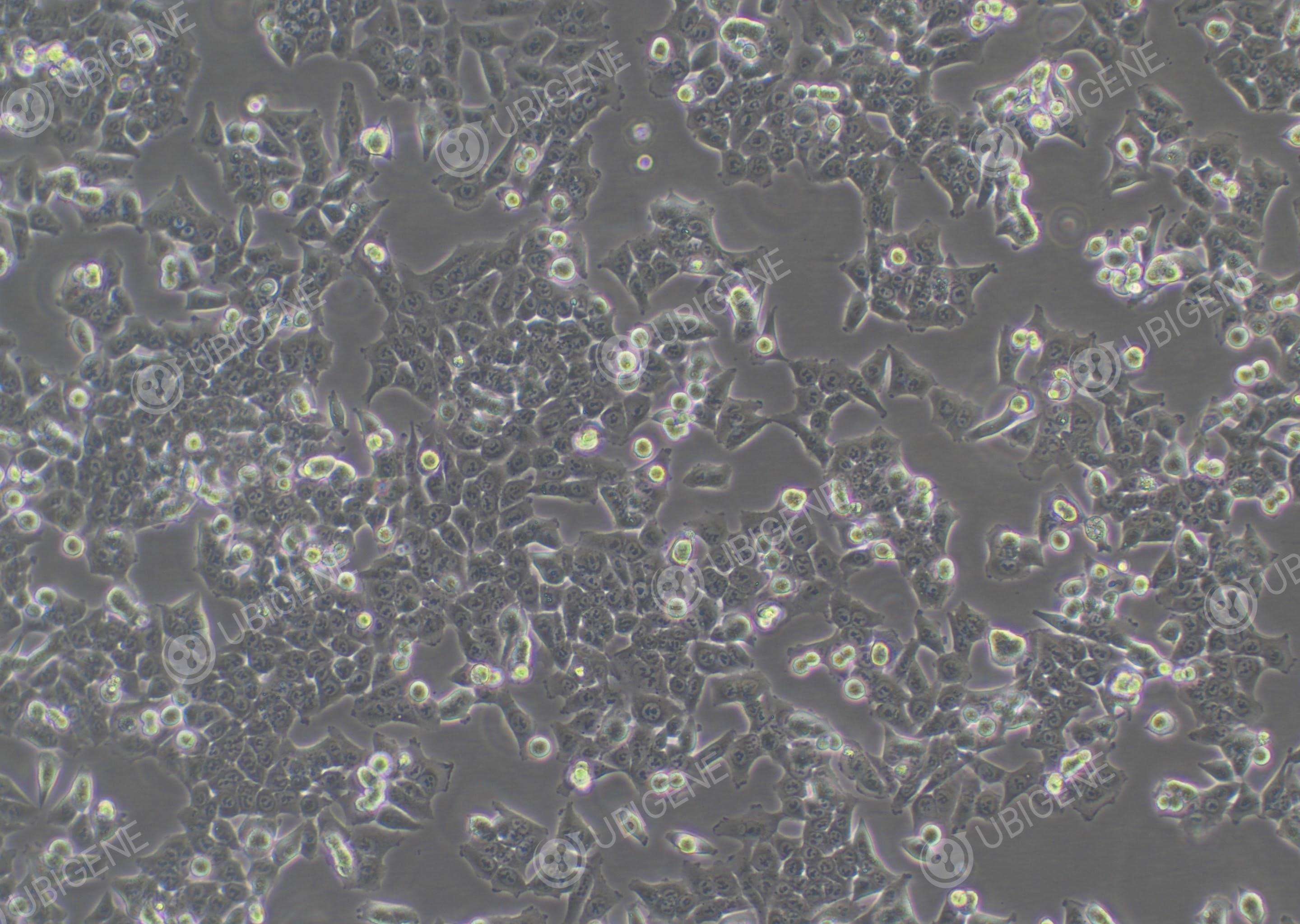 HCT 116 cell line | Ubigene