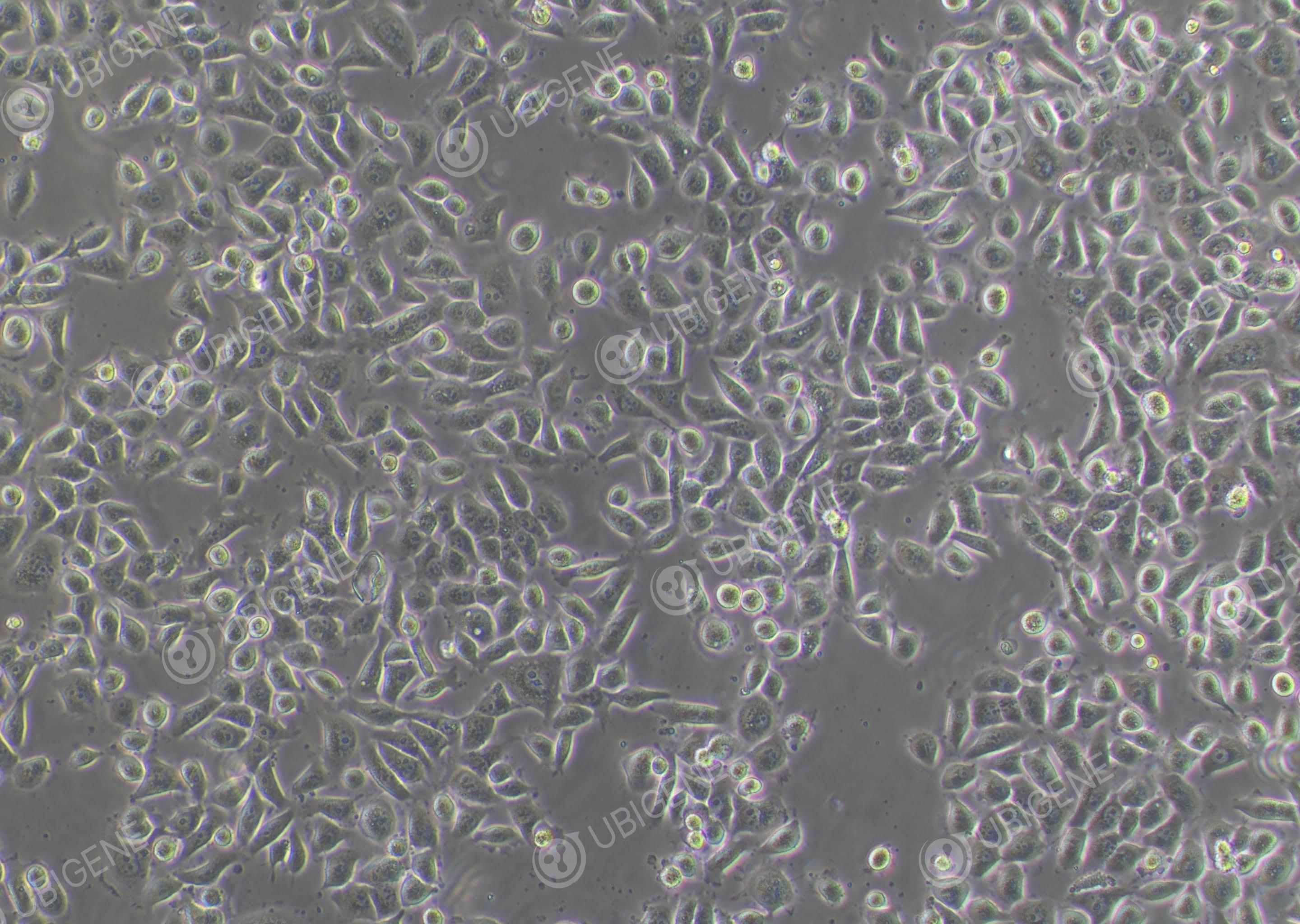 HK-1 cell line | Ubigene