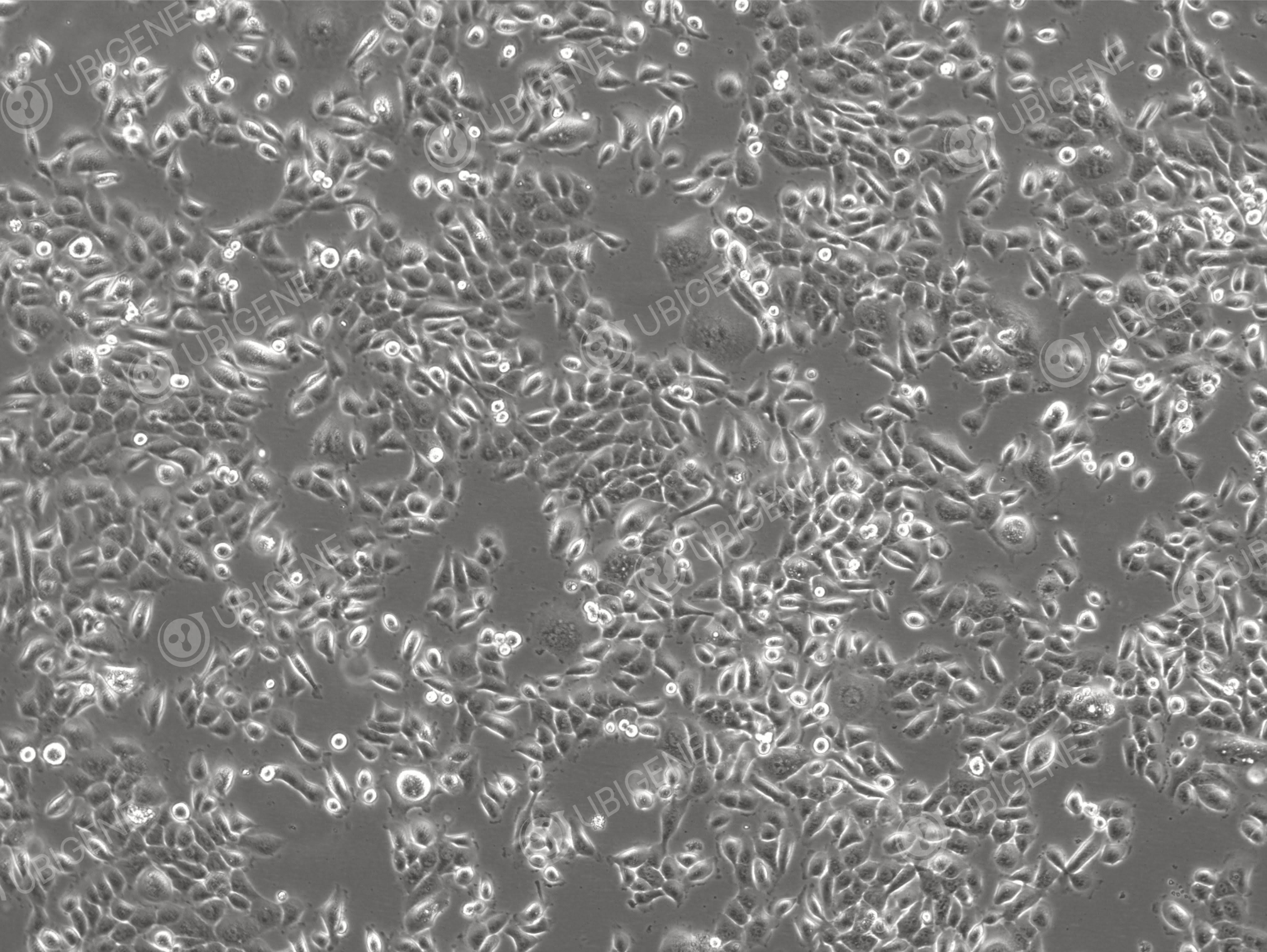 HK-1 cell line | Ubigene