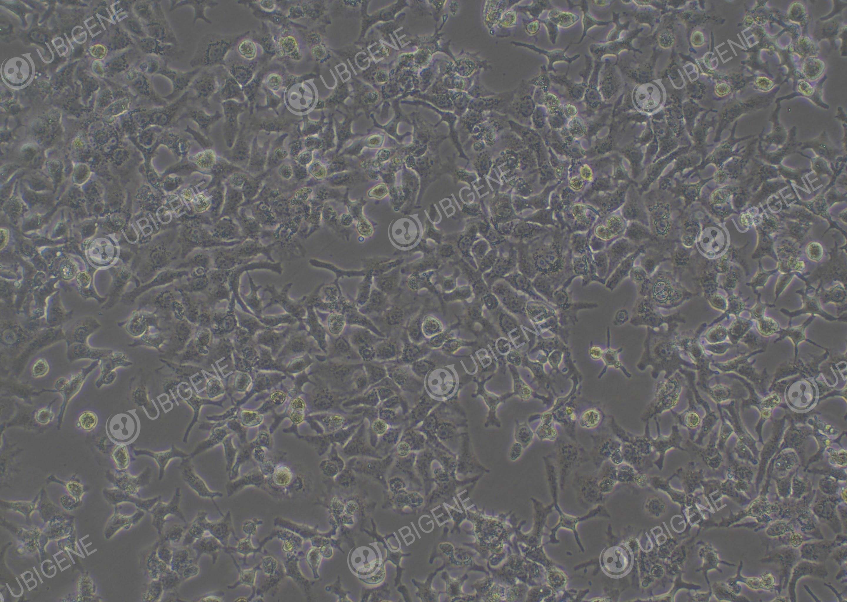 人肝癌细胞(HuH-7)_源井生物【官网】