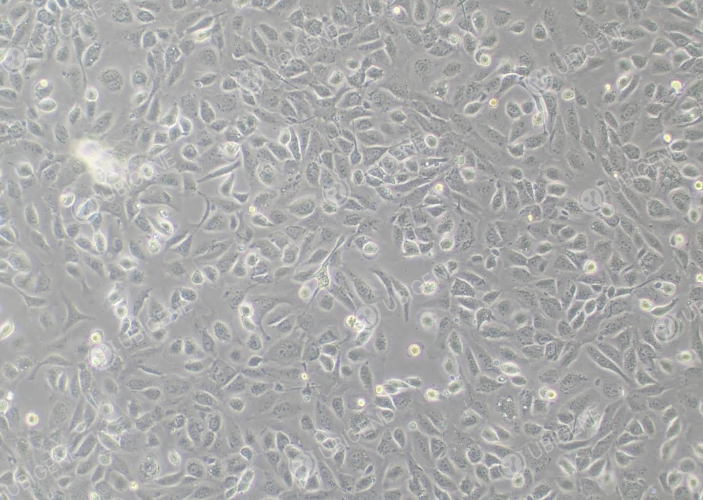 ID8 -Luc cell line | Ubigene