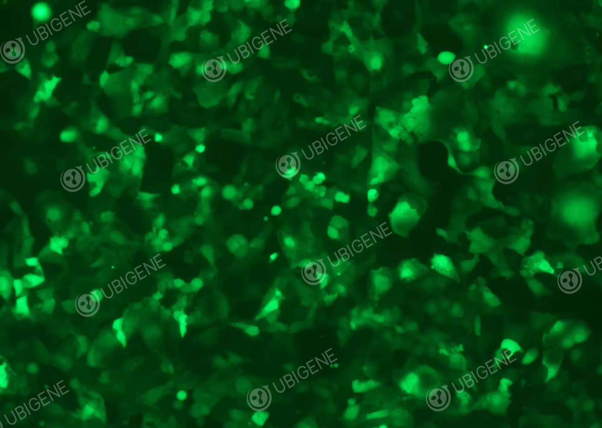 ISHIKAWA-Luc cell line | Ubigene