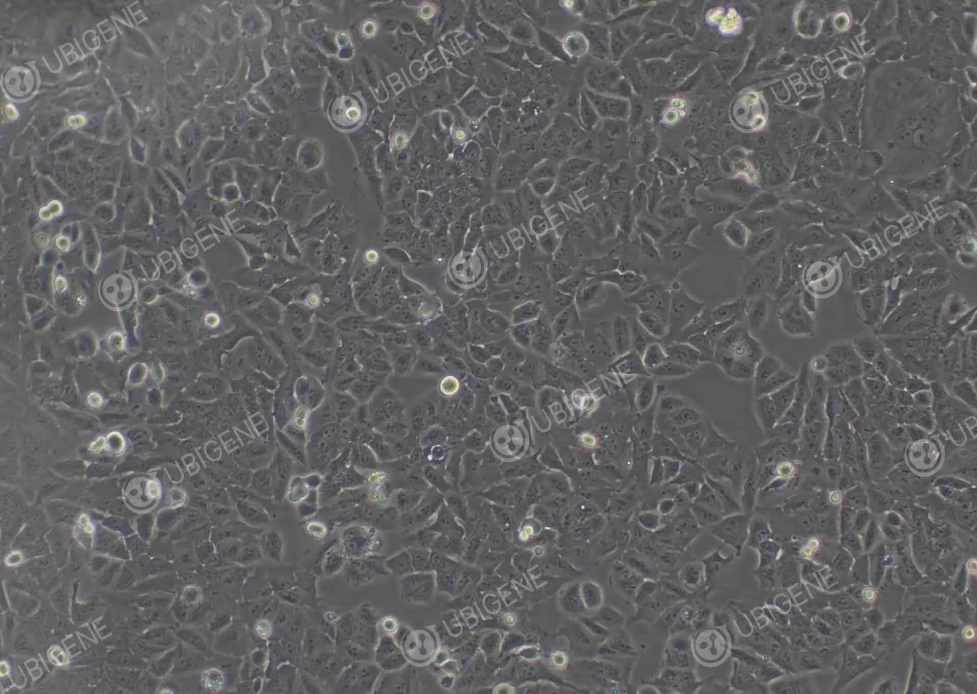 ISHIKAWA-Luc cell line | Ubigene