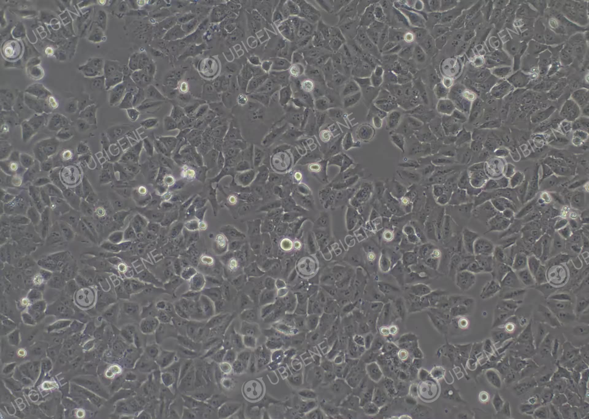 ISHIKAWA cell line | Ubigene