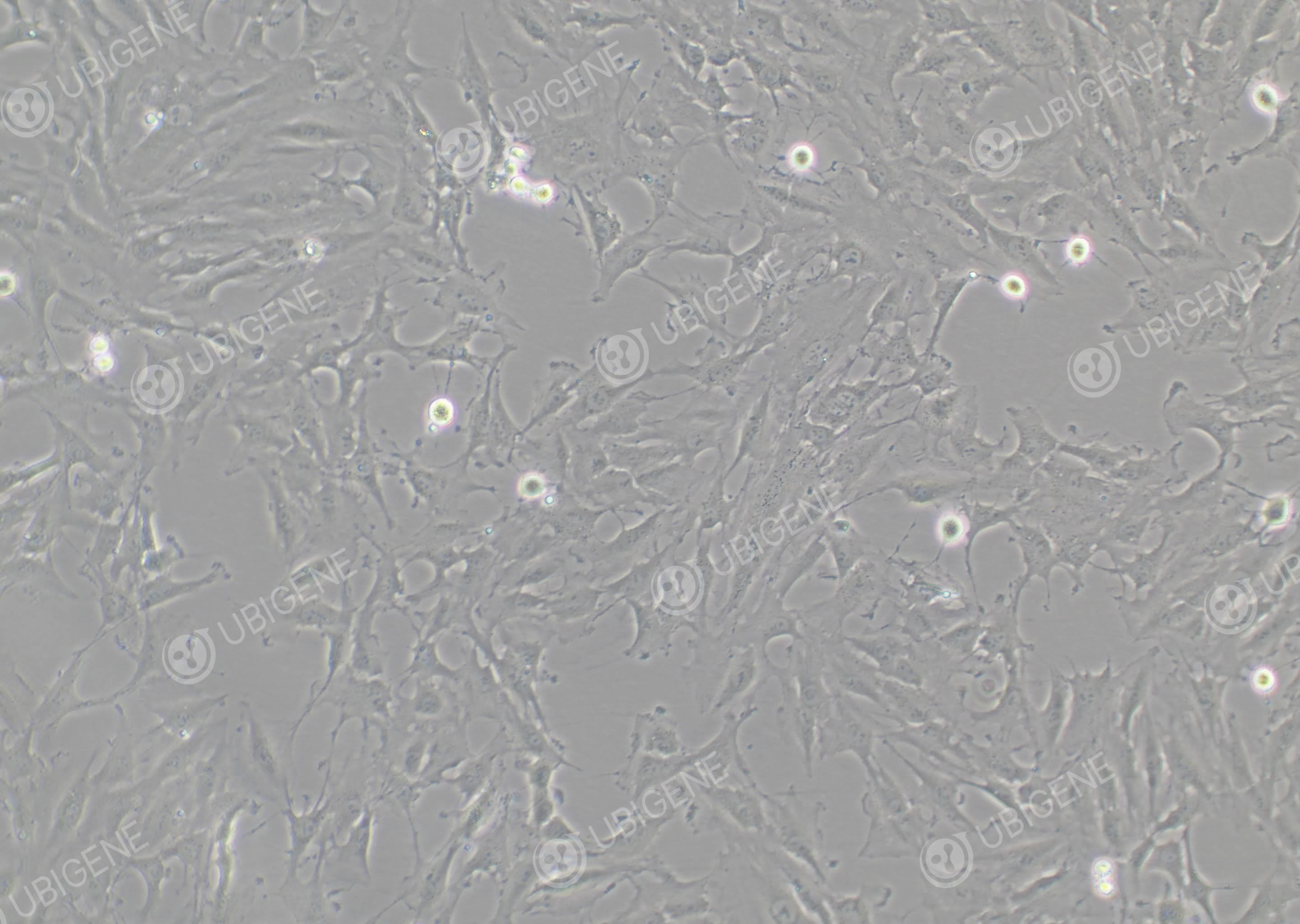 KGN cell line | Ubigene