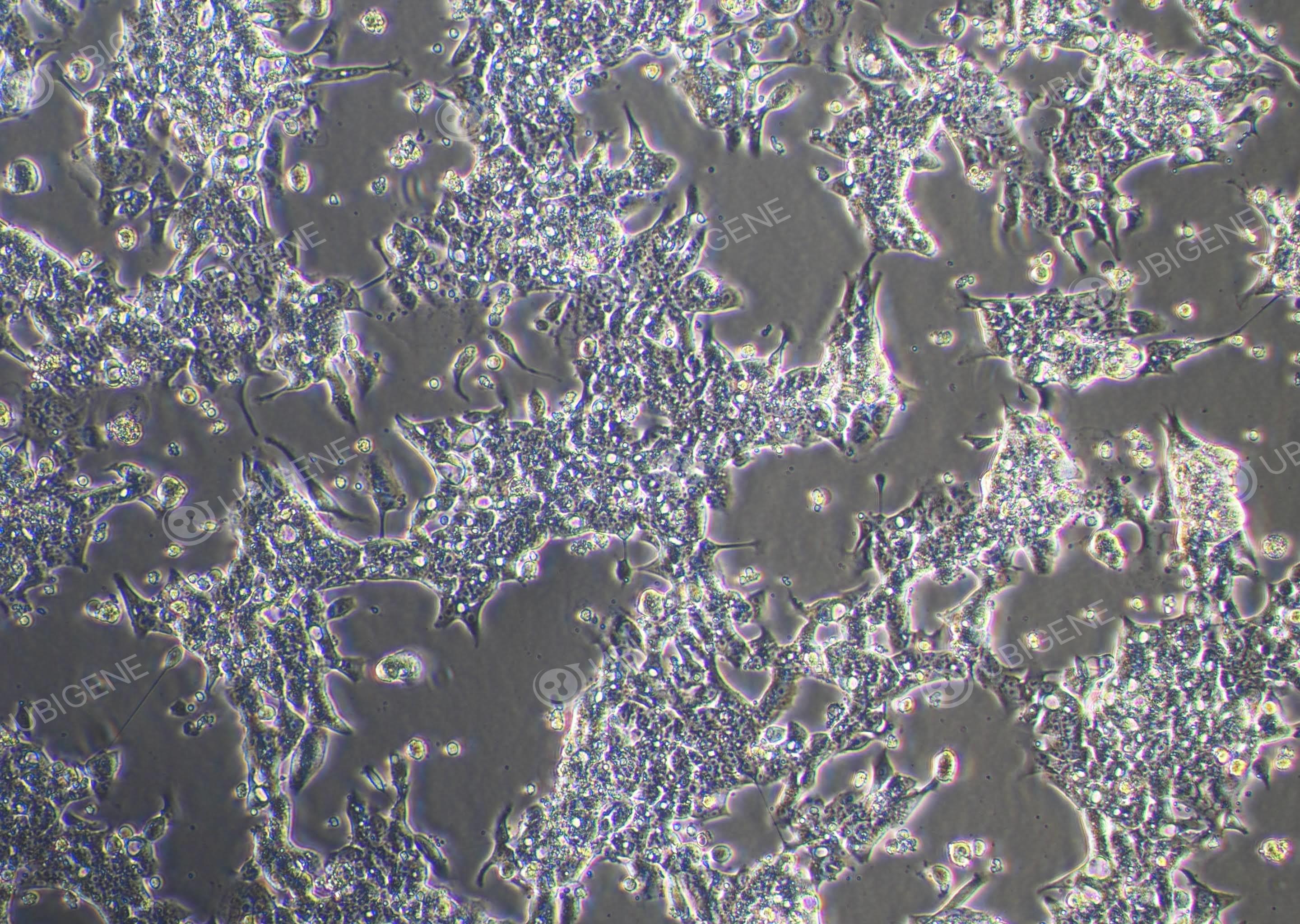 LoVo cell line | Ubigene