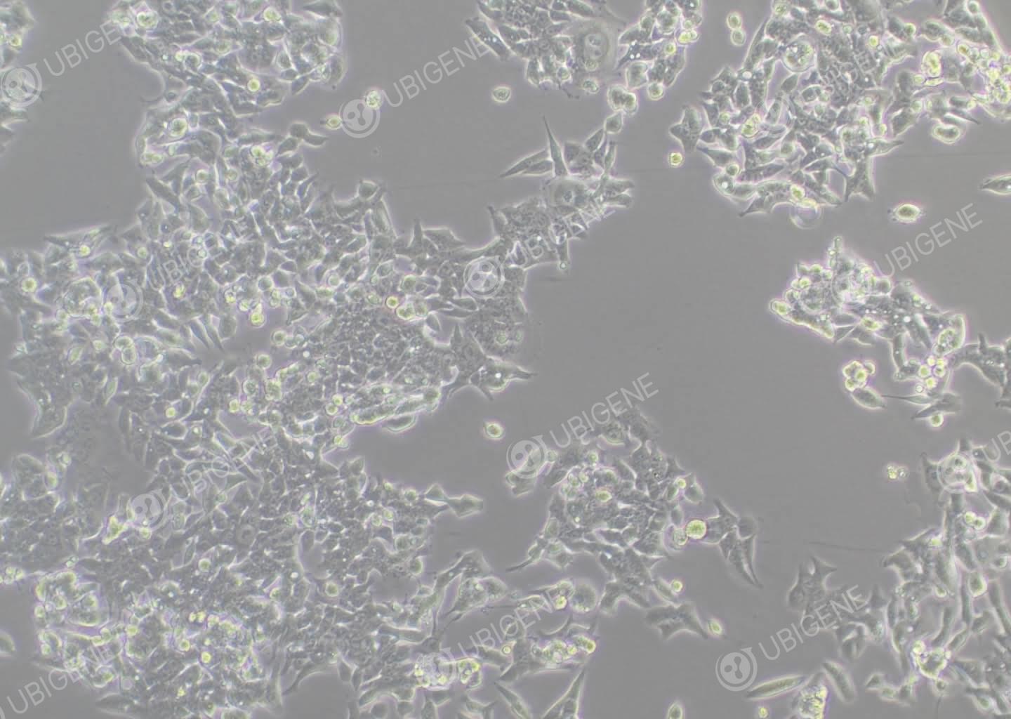 LoVo cell line | Ubigene