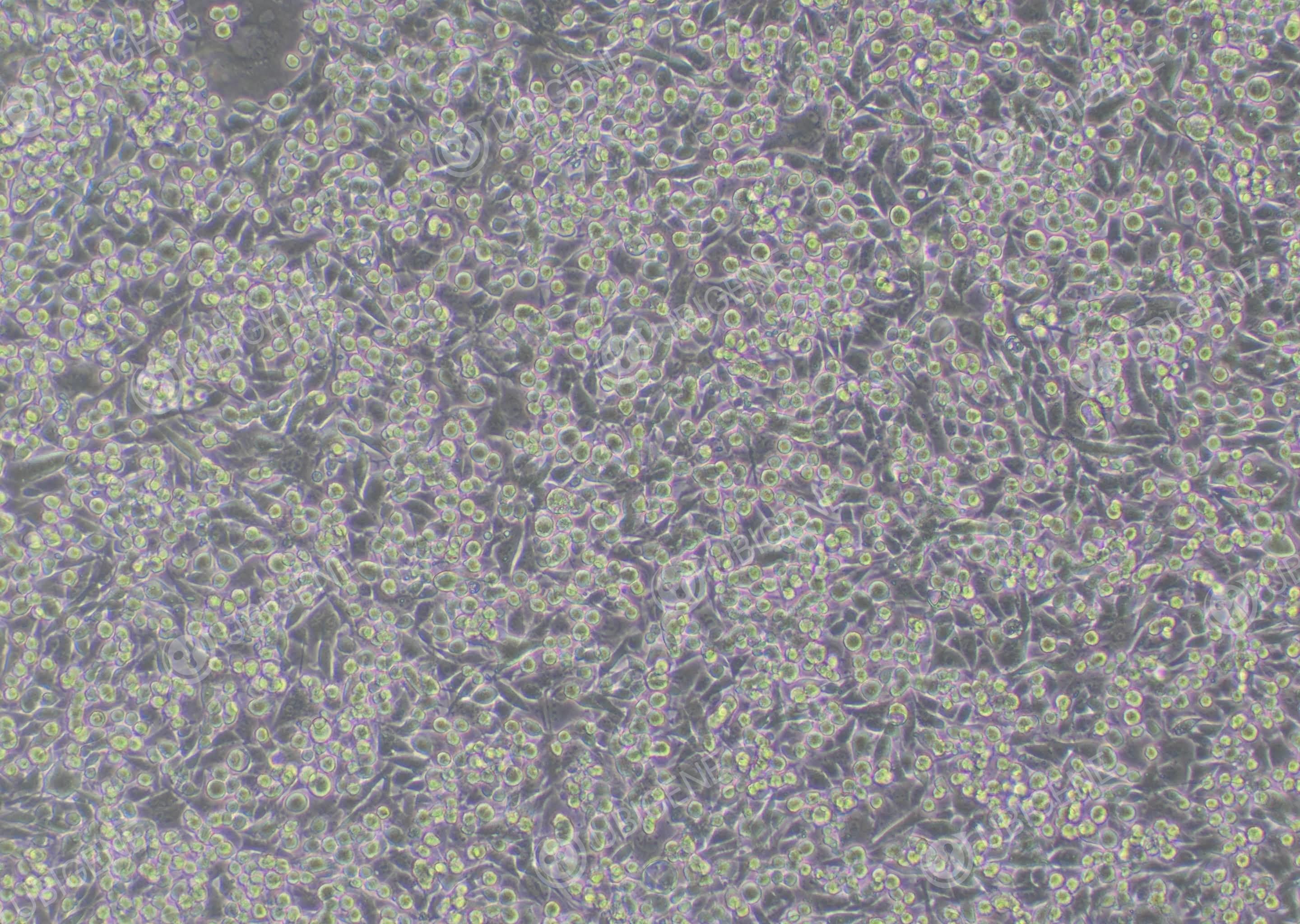 MB-49 cell line | Ubigene