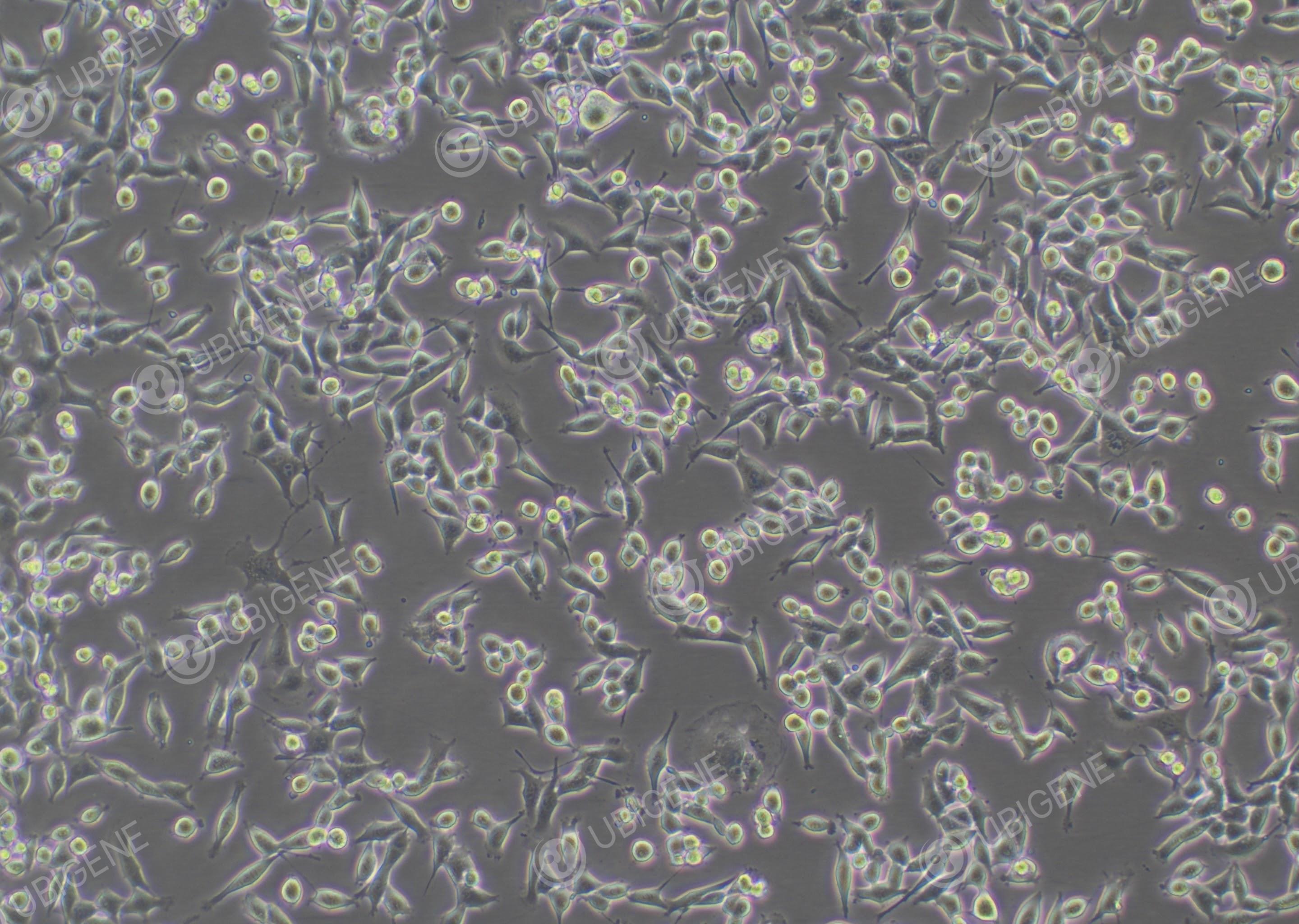 MC38 cell line | Ubigene