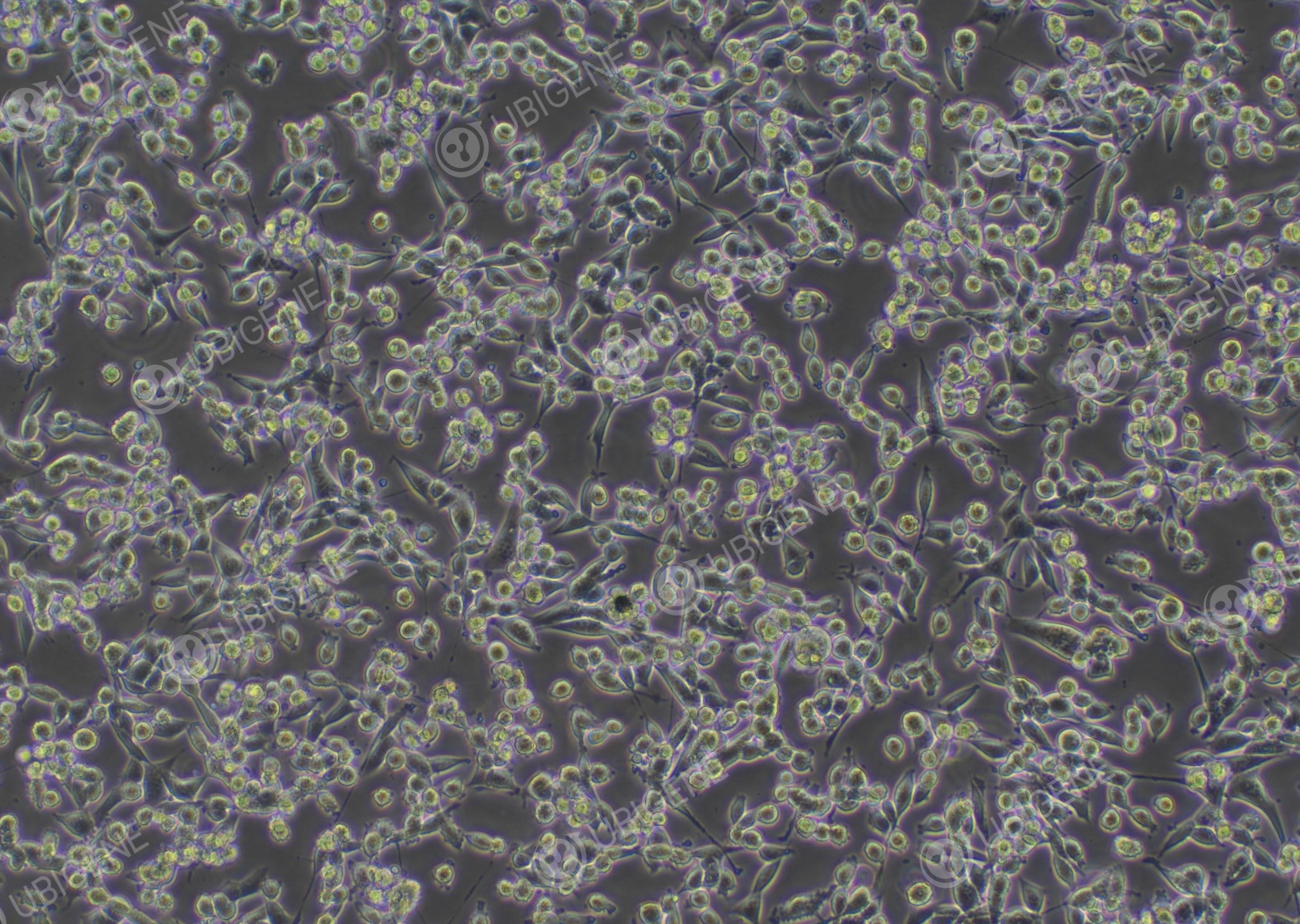 MC38 cell line | Ubigene