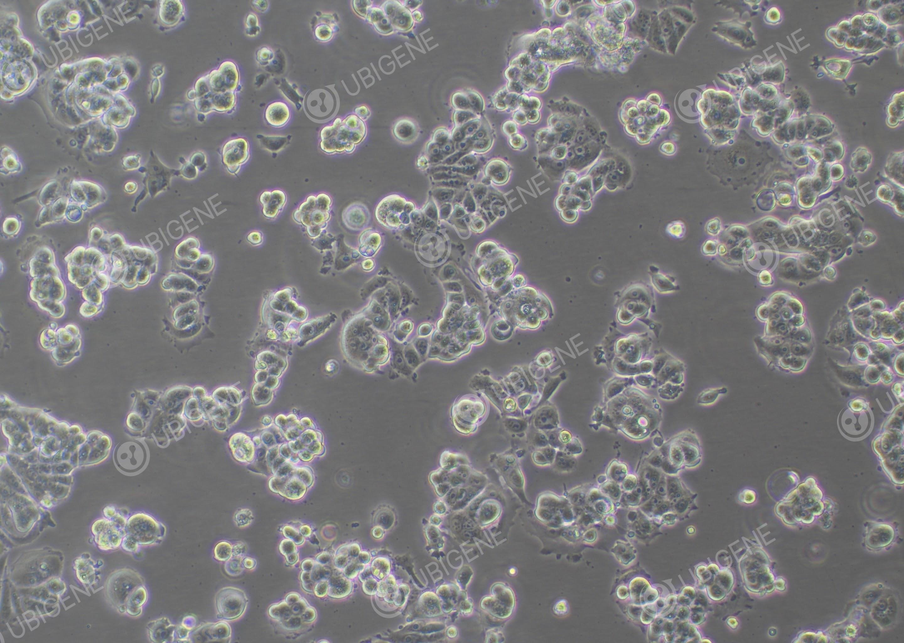 MCF7 cell line | Ubigene
