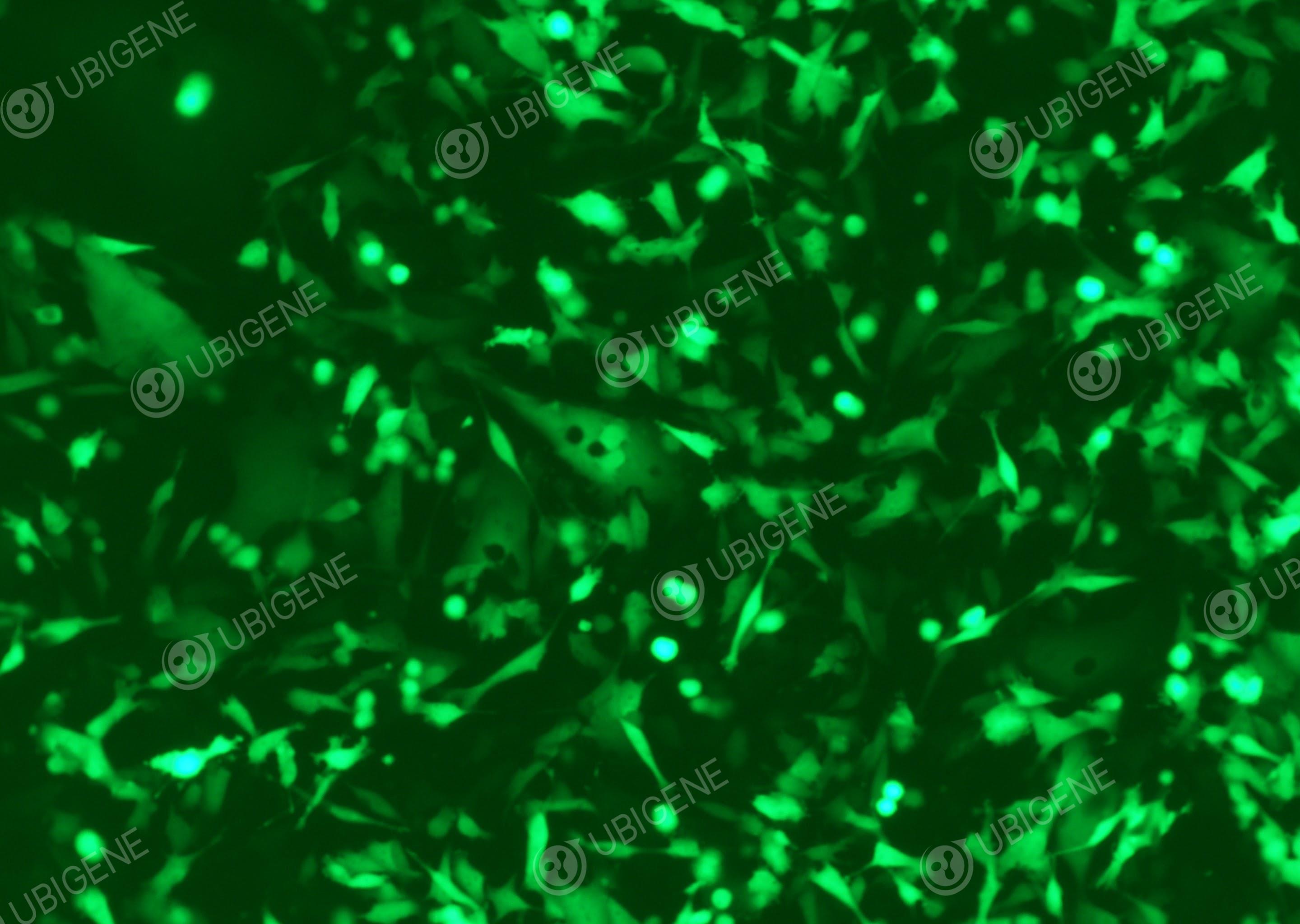 MDA-MB-231 cell line | Ubigene