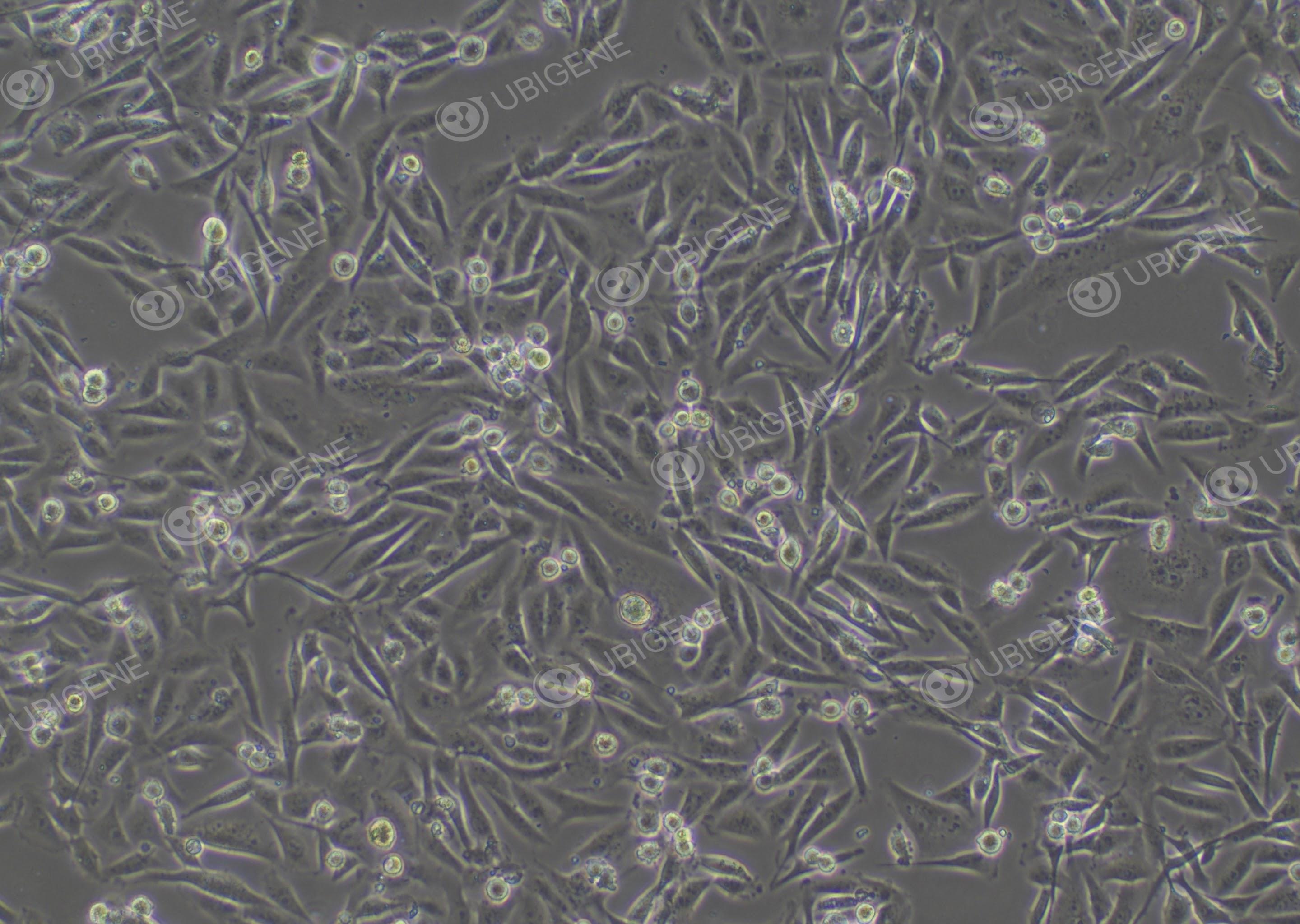 MDA-MB-231 cell line | Ubigene