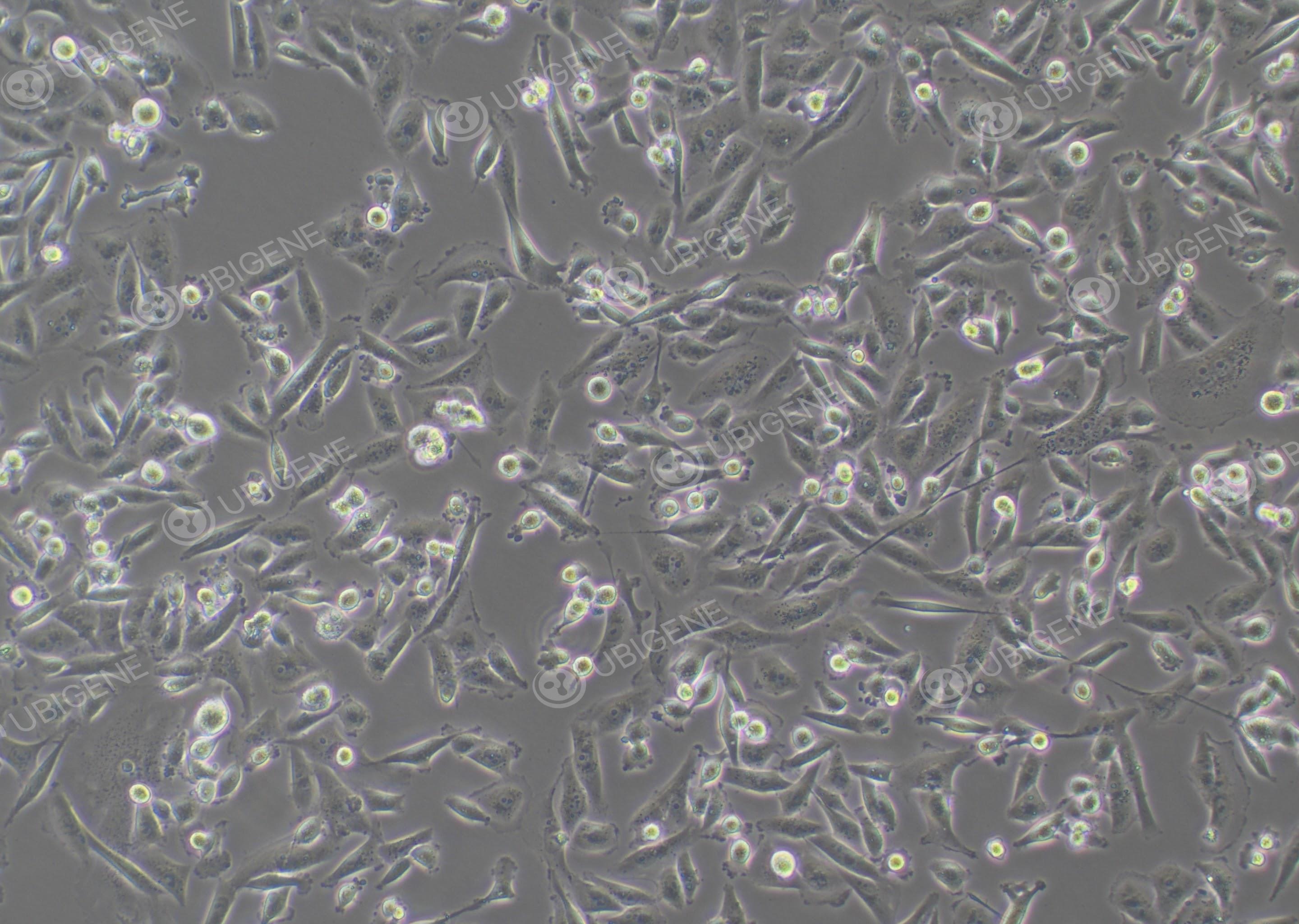 MDA-MB-231 cell line | Ubigene