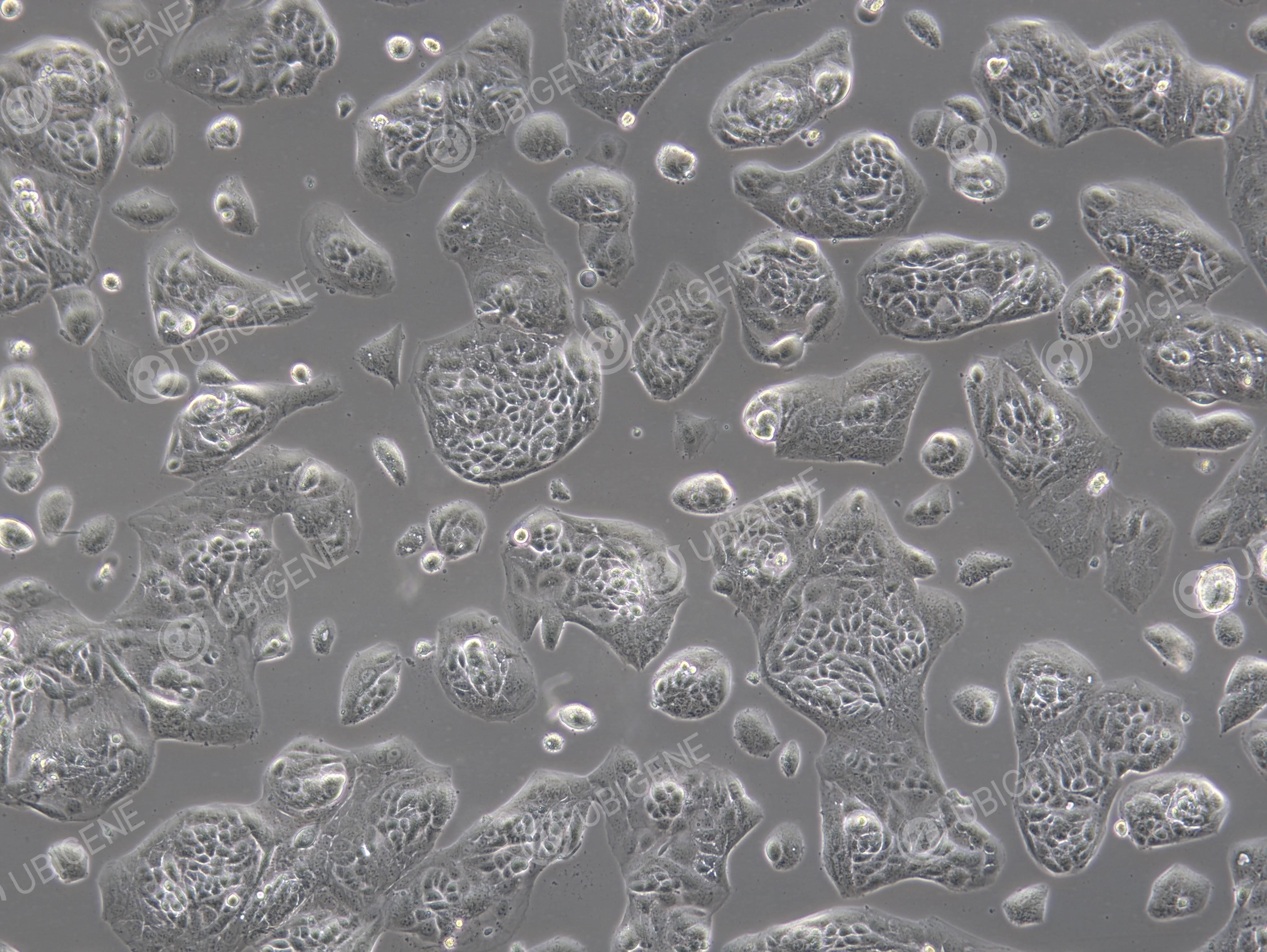 MFE-280-Luc cell line | Ubigene