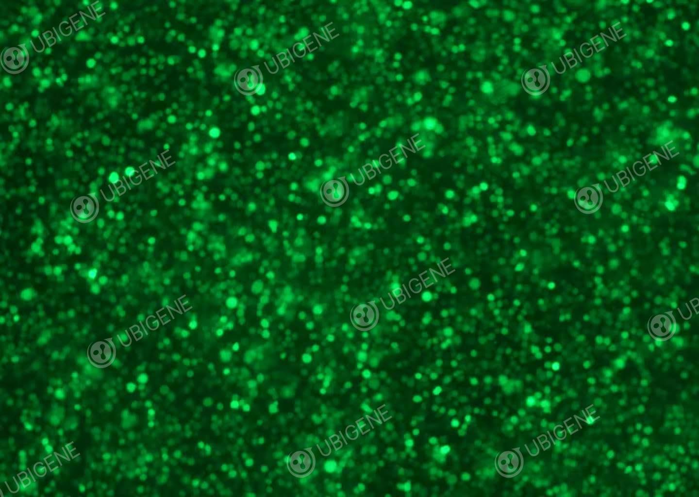 MM.1S cell line | Ubigene