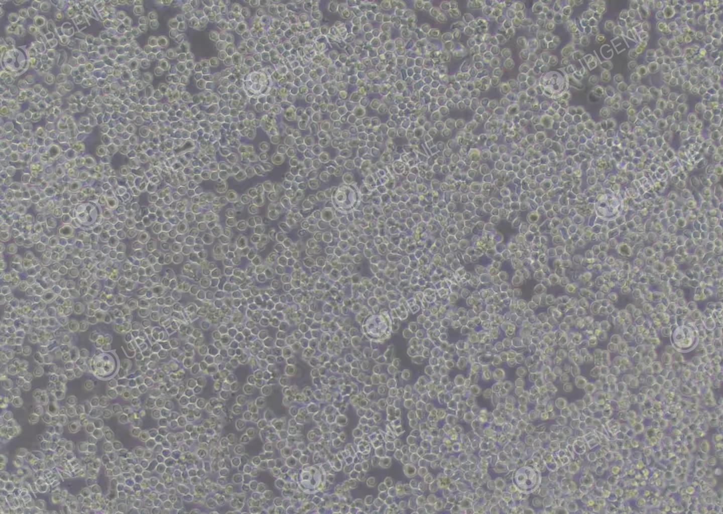 MM.1S cell line | Ubigene