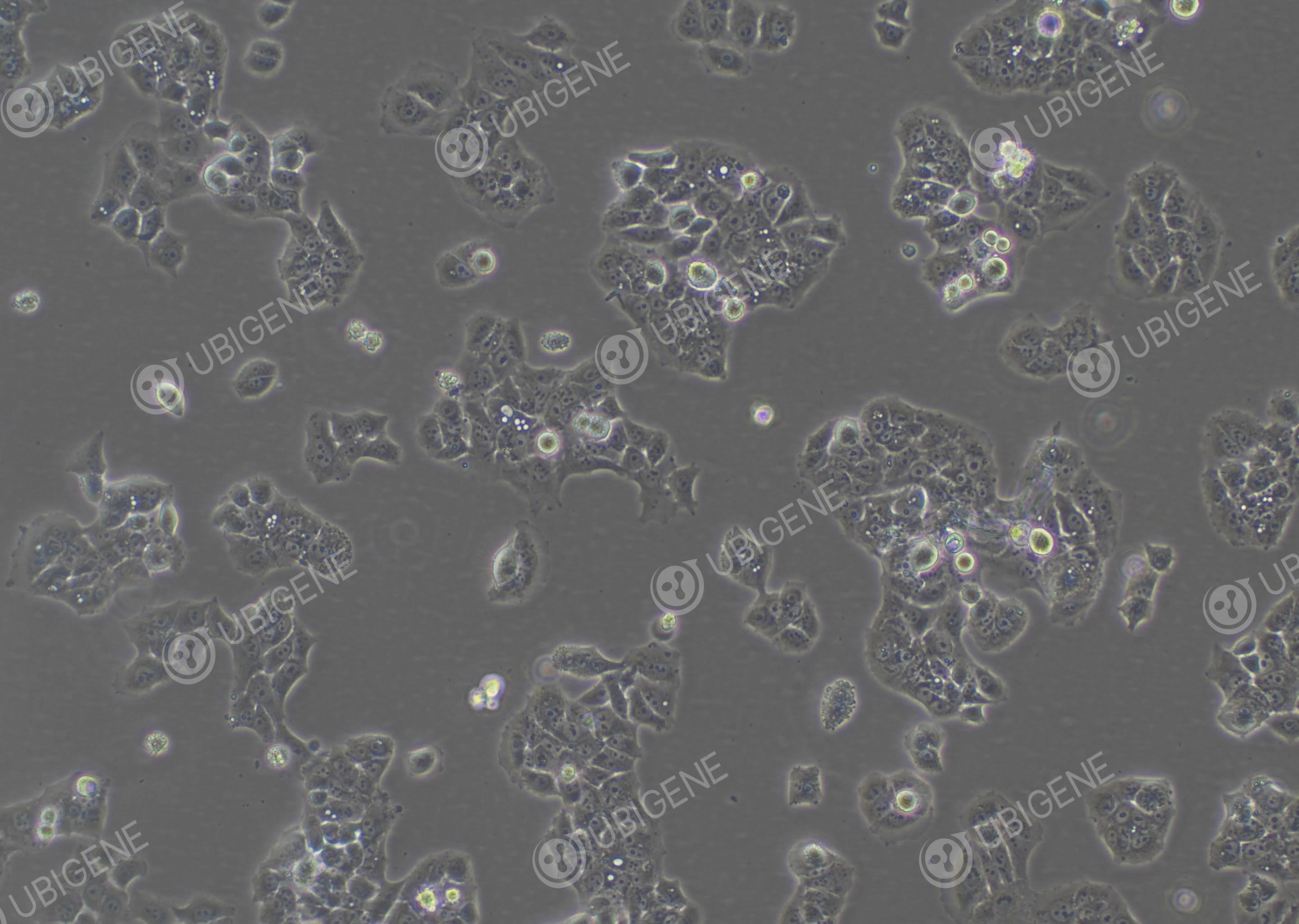 人肾透明细胞腺癌细胞(MS751)_源井生物【官网】