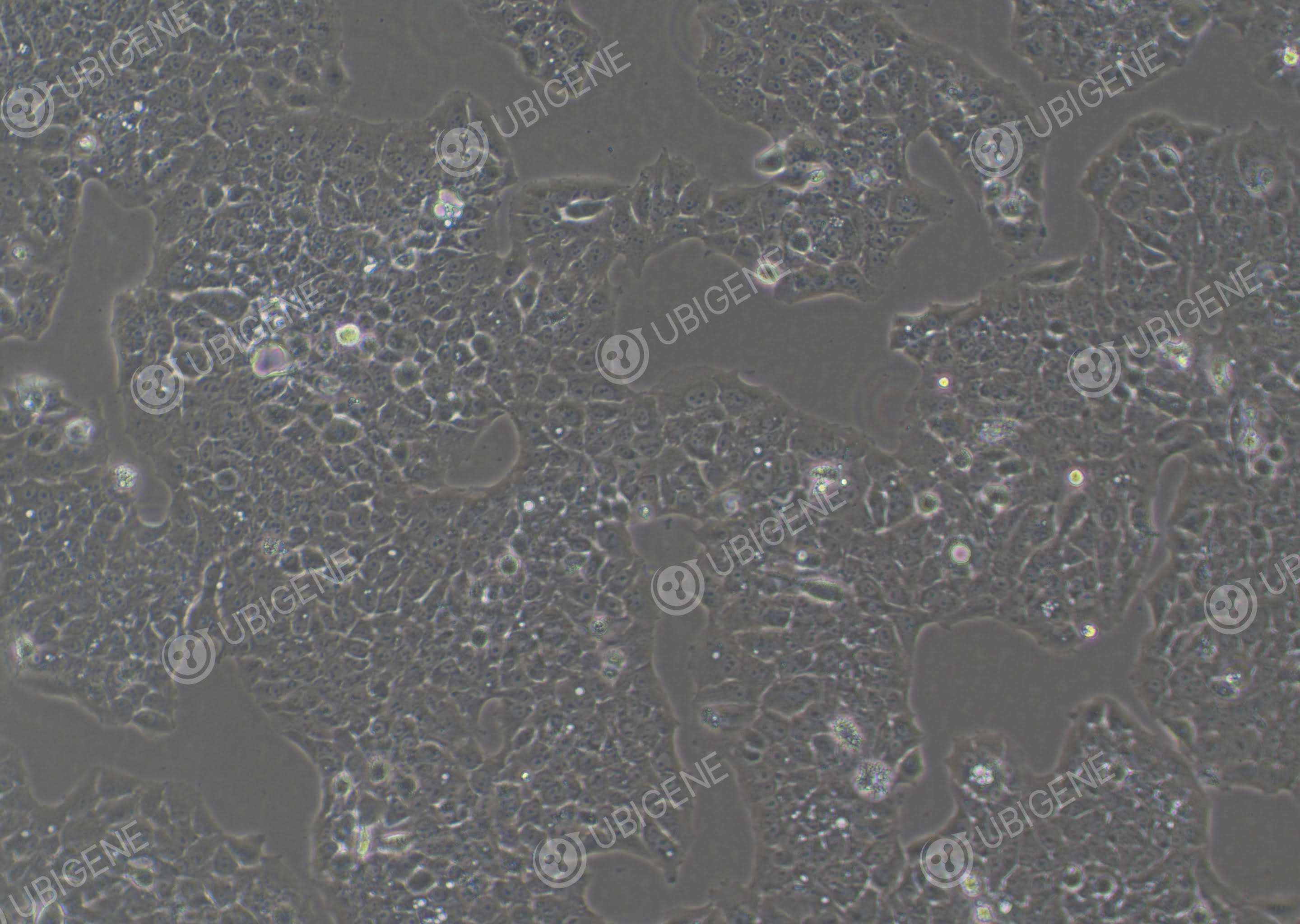 人肾透明细胞腺癌细胞(MS751)_源井生物【官网】