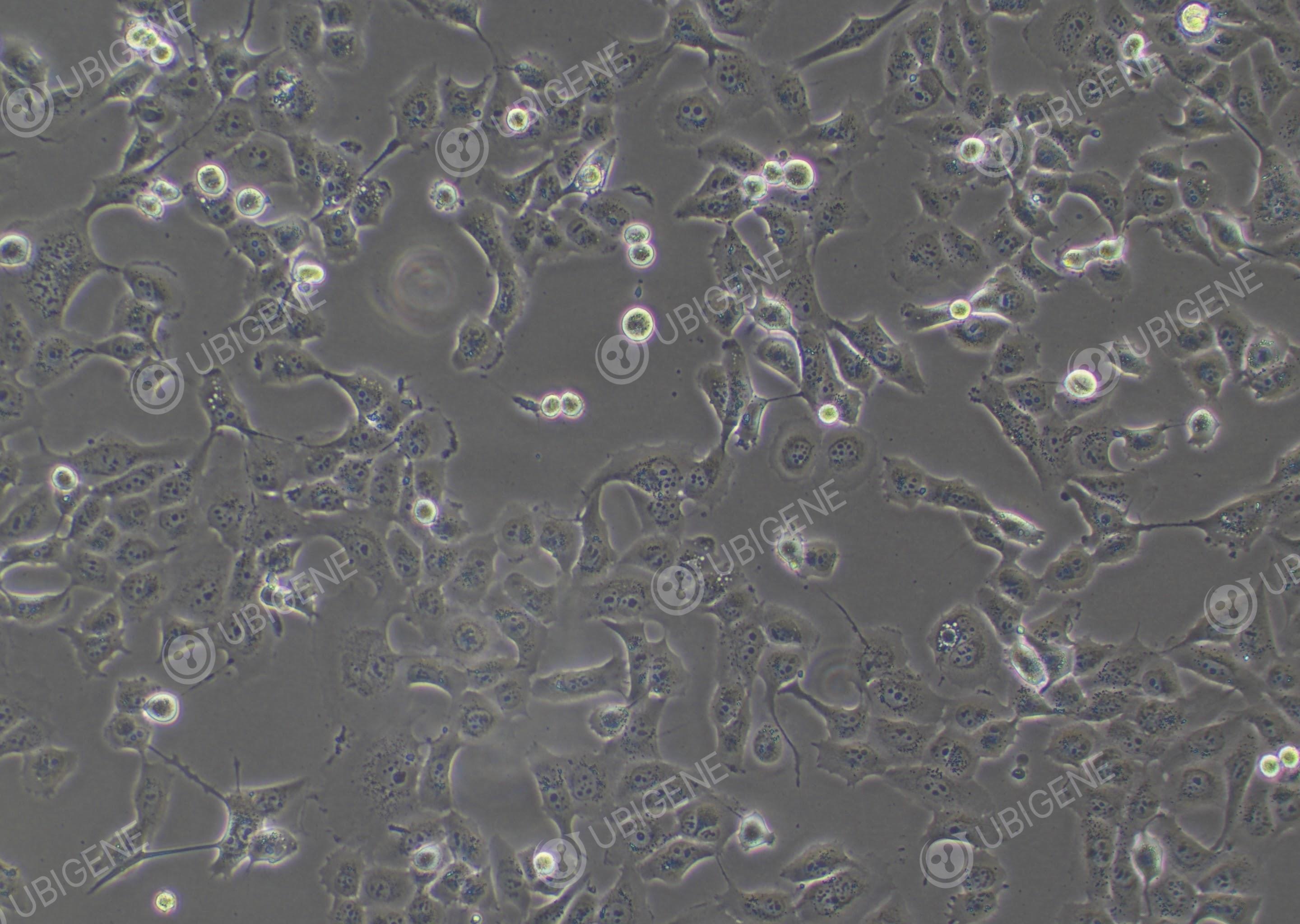 NCI-H1299 cell line | Ubigene