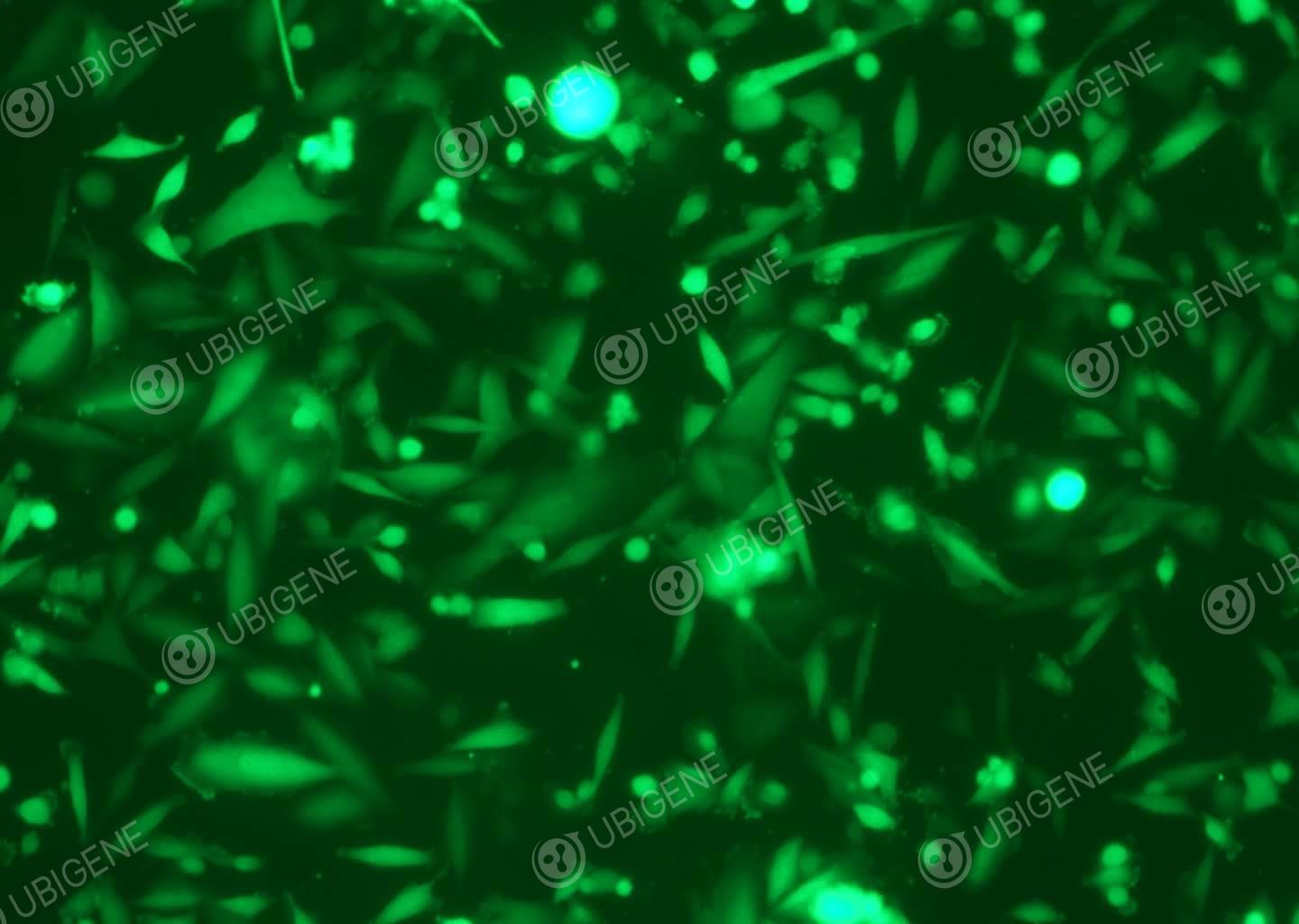 NCI-H1975 cell line | Ubigene