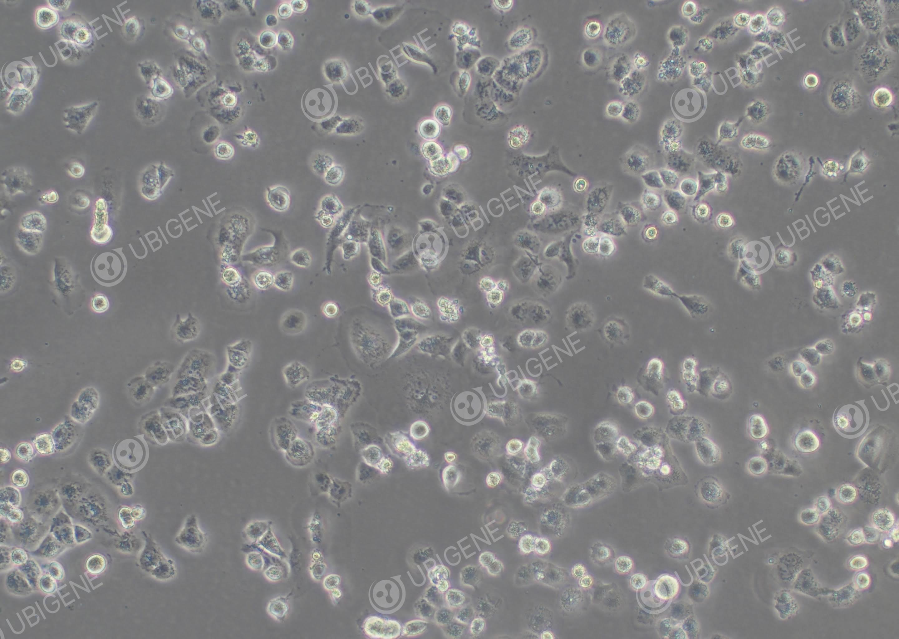 NCI-H23-Luc cell line | Ubigene