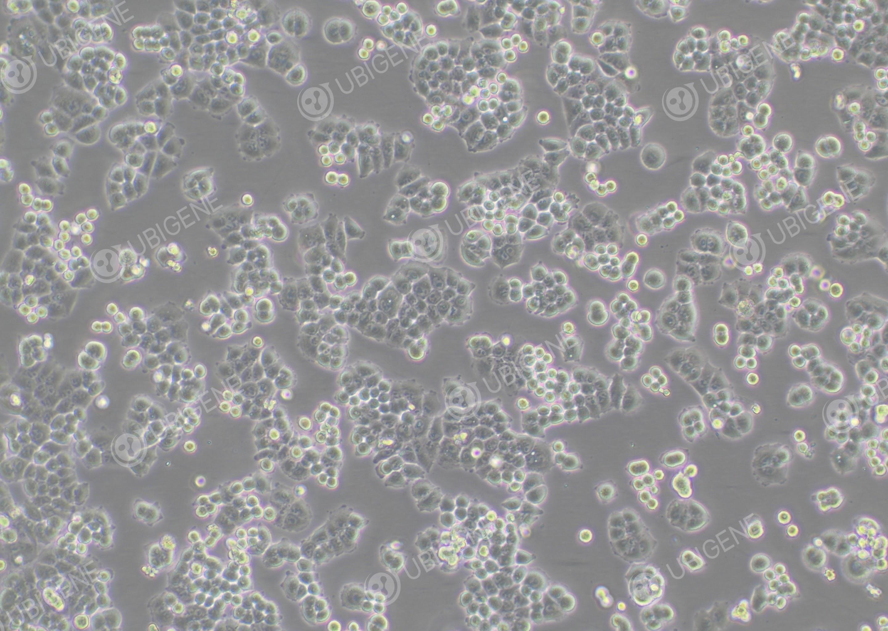 NCI-H460 cell line | Ubigene