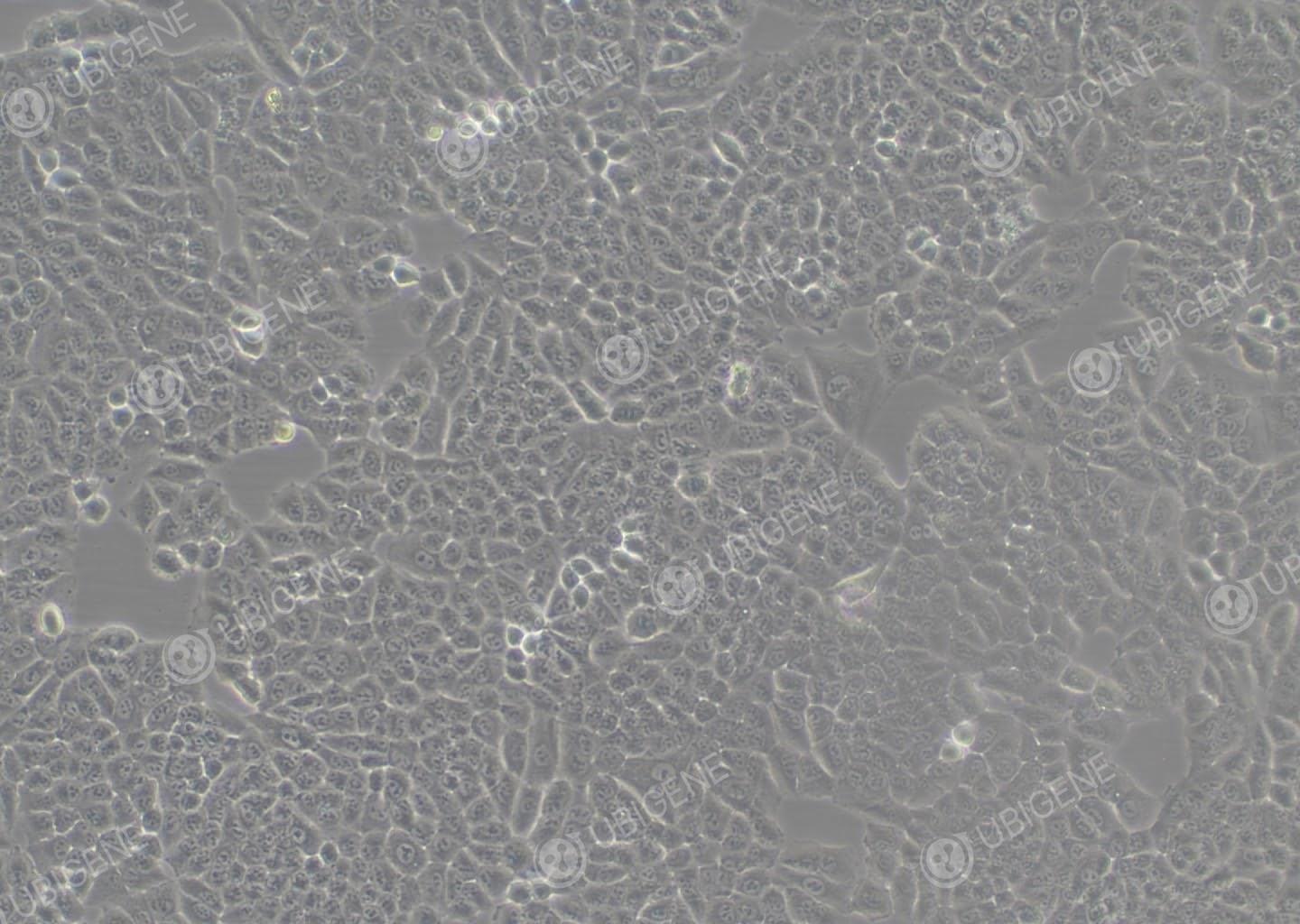 NCI-H460 cell line | Ubigene