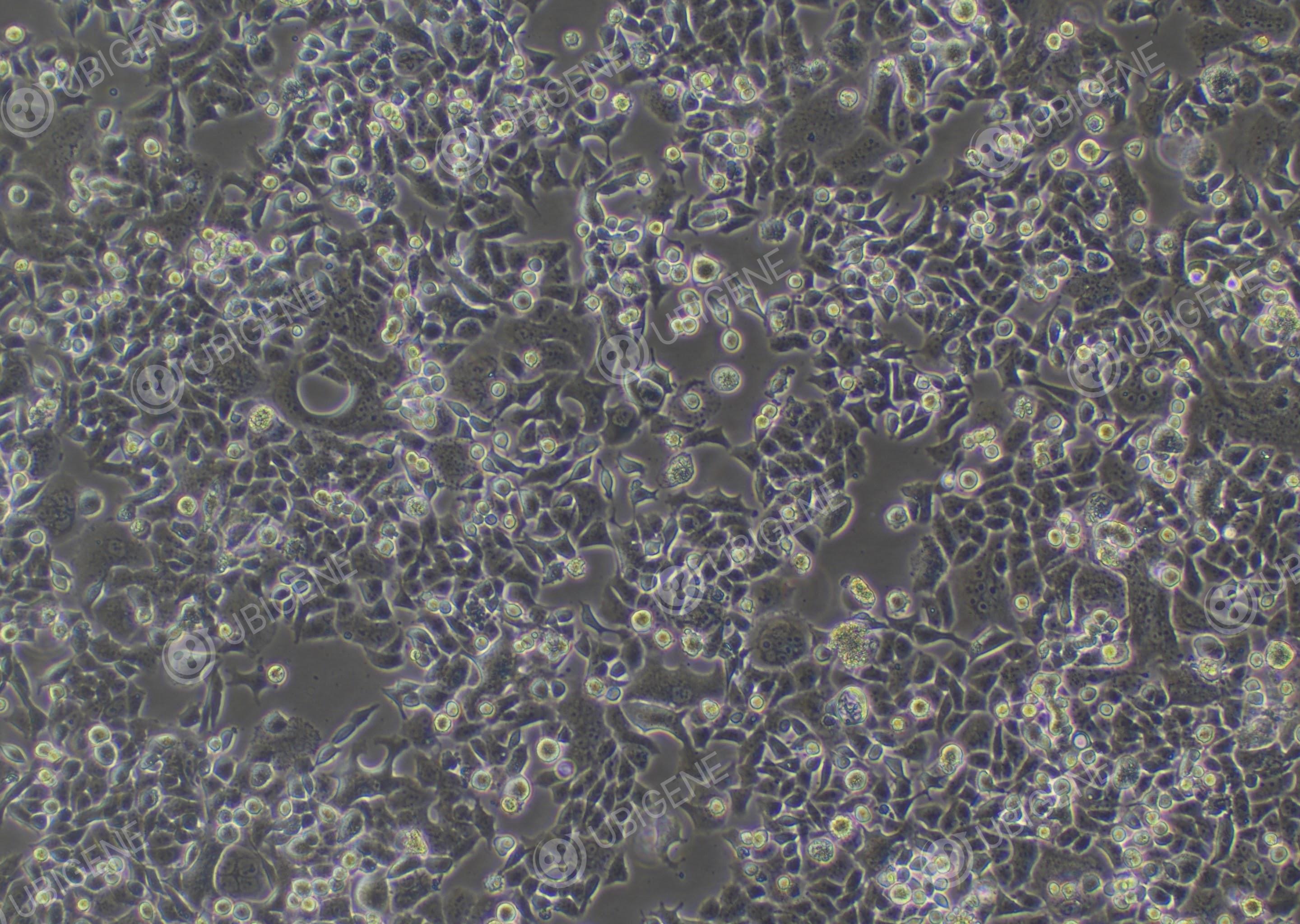 NCI-H520 cell line | Ubigene