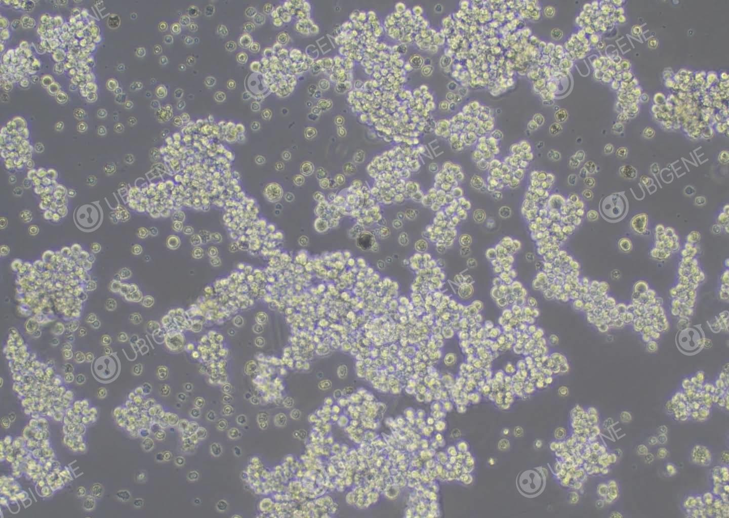 NCI-H716 cell line | Ubigene