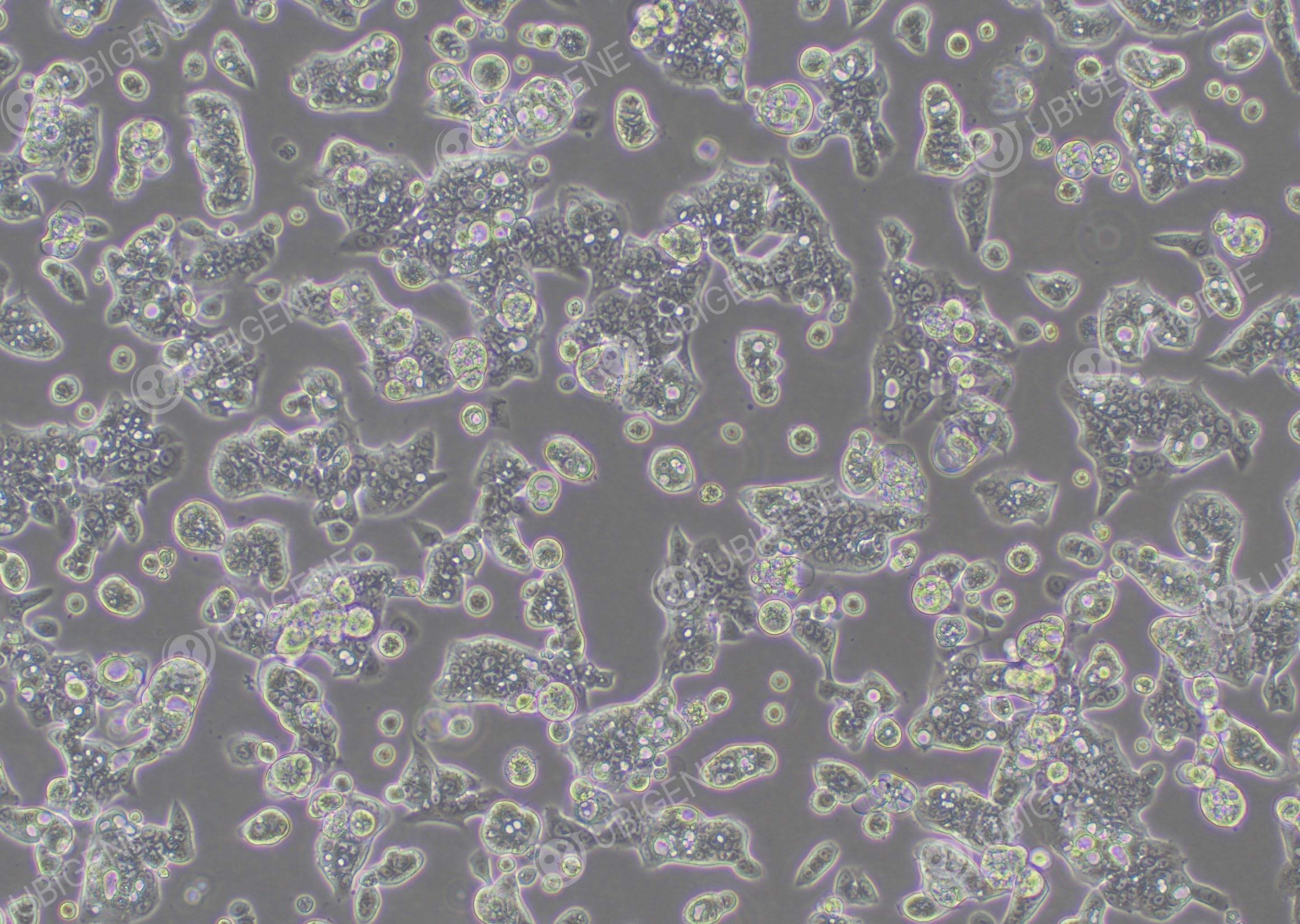 NCI-N87 cell line | Ubigene