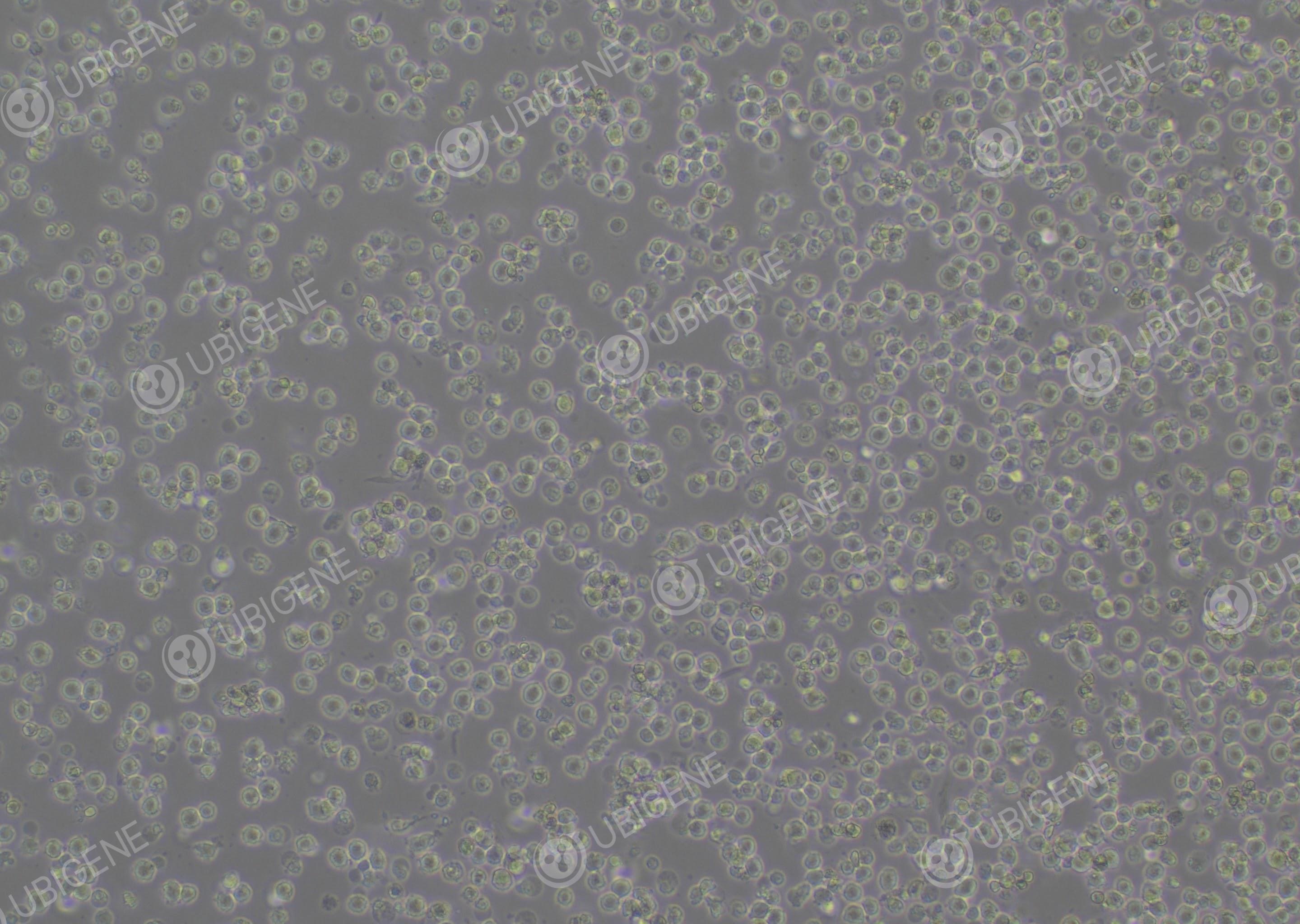 OCI-Aml-3 cell line | Ubigene