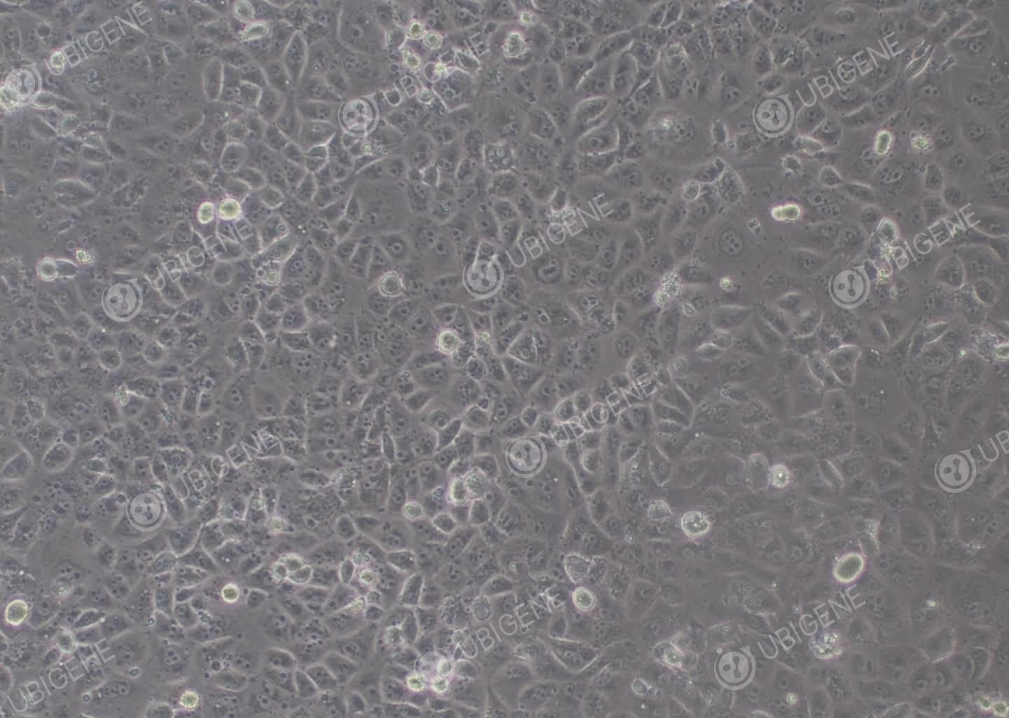 Panc-1 cell line | Ubigene