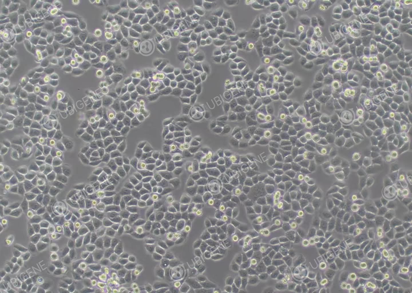 SGC-7901-Luc cell line | Ubigene