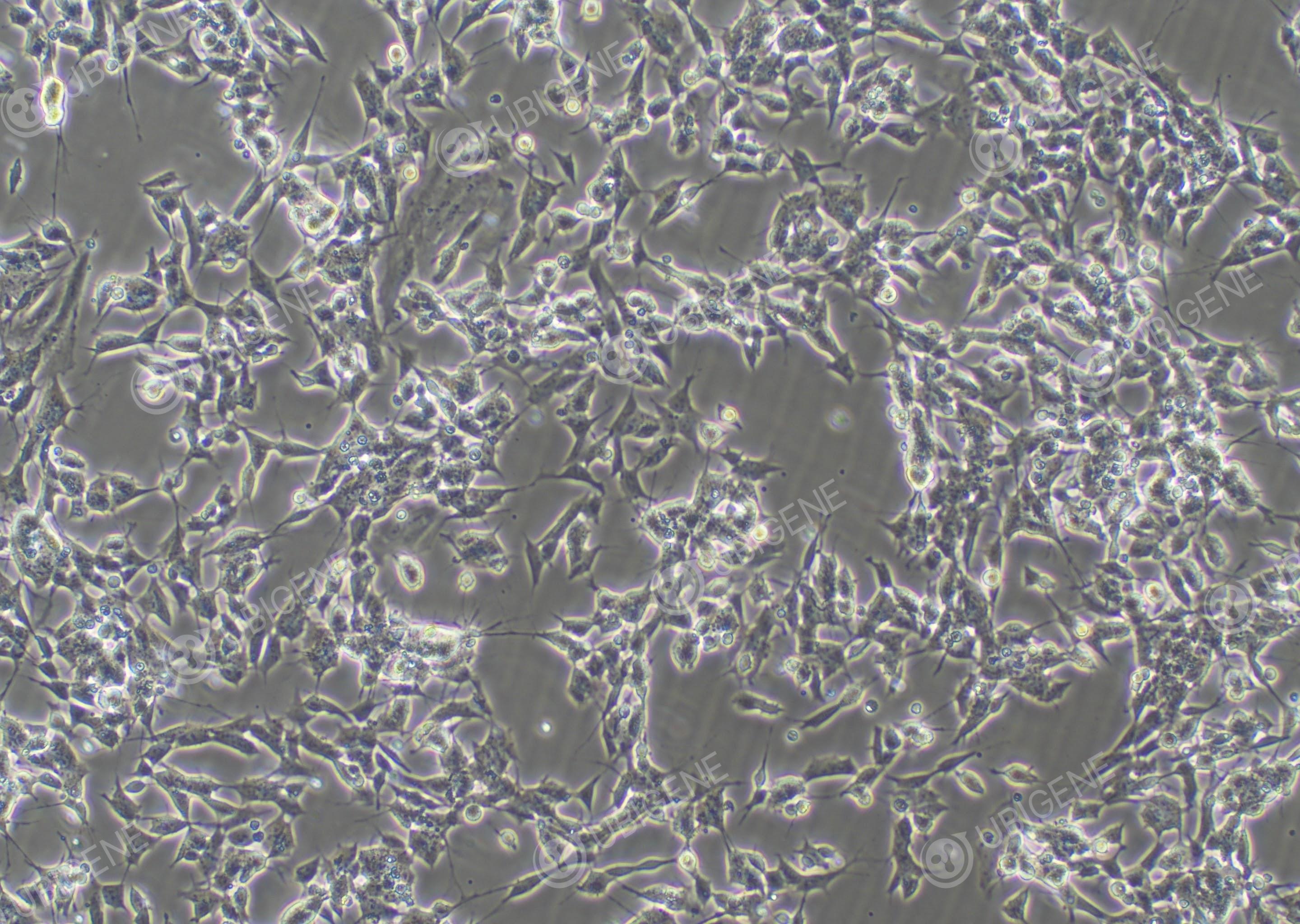 SH-SY5Y cell line | Ubigene