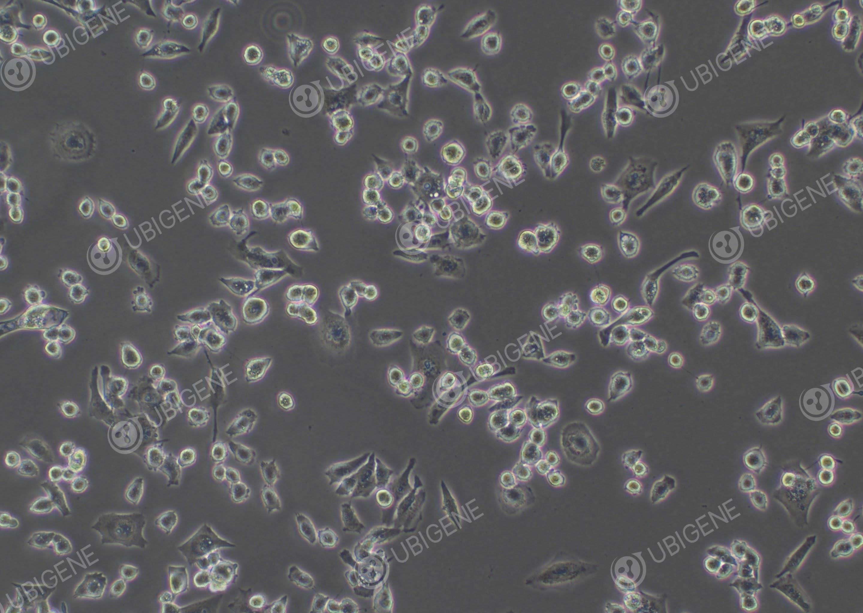 人肝癌细胞(SMMC-7721)_源井生物【官网】